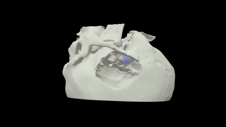 Posterior-fossa 3D models - Sketchfab