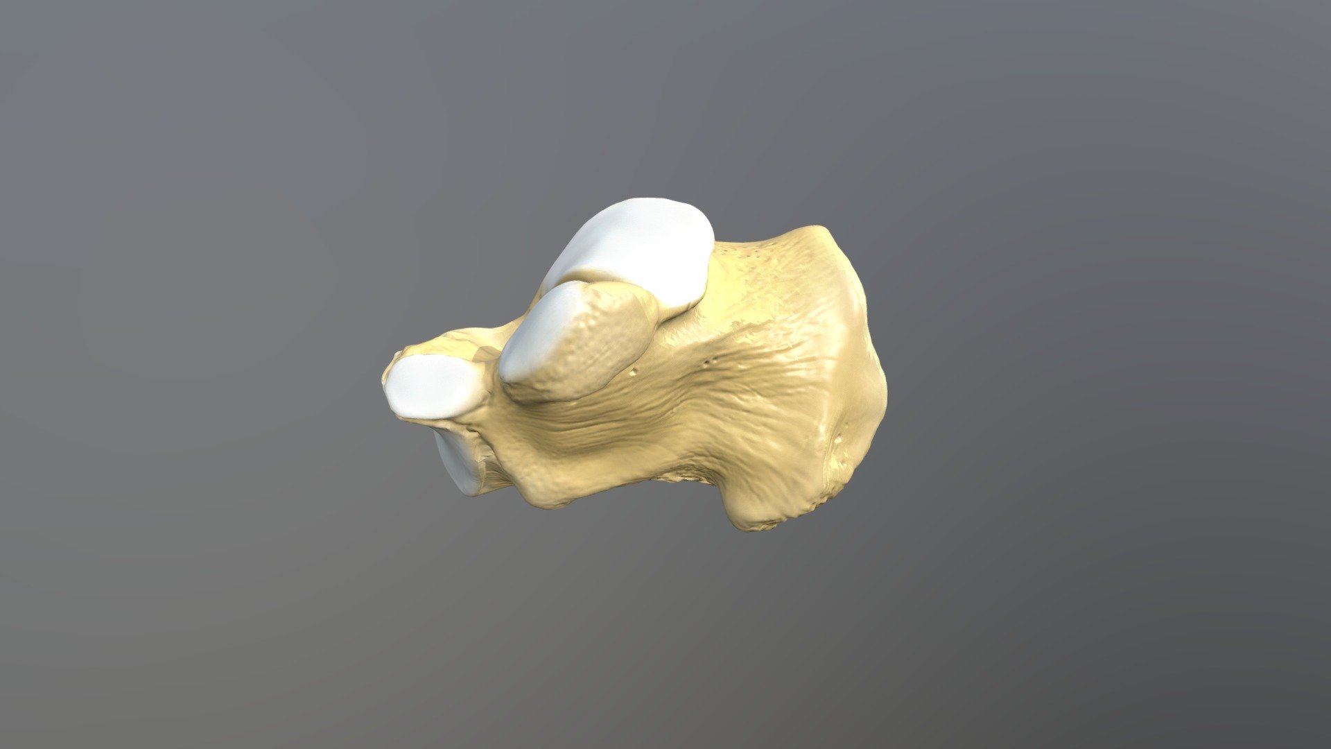 Calcaneus - Buy Royalty Free 3D model by humantouchillustration ...