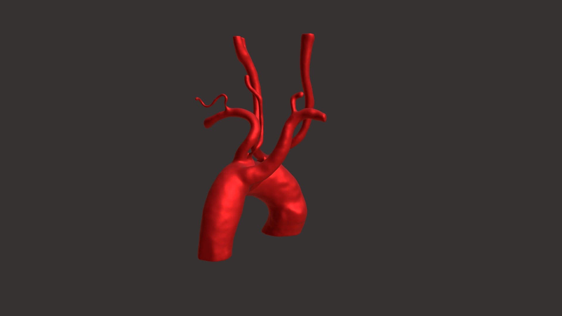 Aortic Arch with Arteria Lusoria - 3D model by terzievstudent [0070ed3 ...