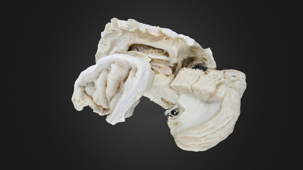 Neuroanatomy - A 3D model collection by ekrueger-UEL (@ekrueger ...