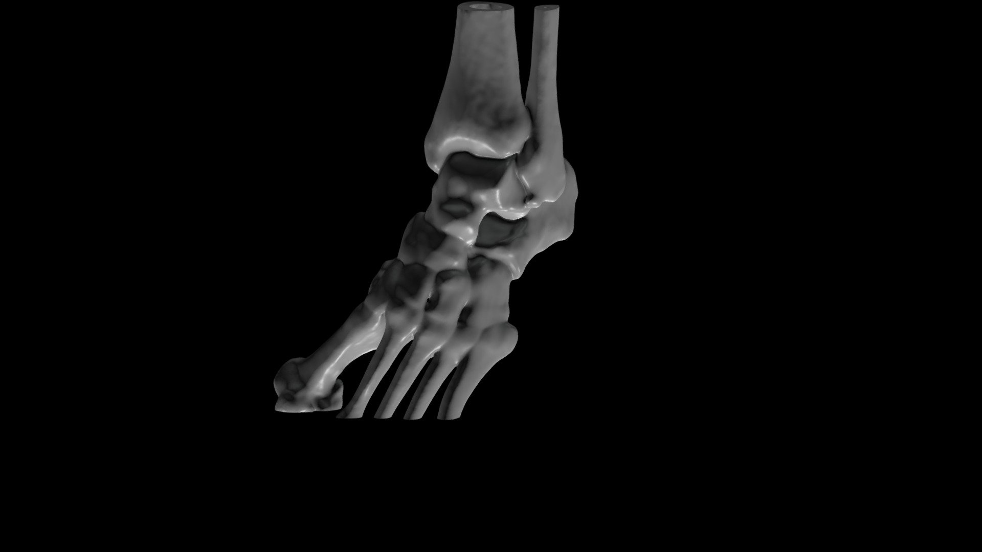 Left Ankle Reconstruction - 3D model by Ivailo.Dimitrov [00c6680 ...