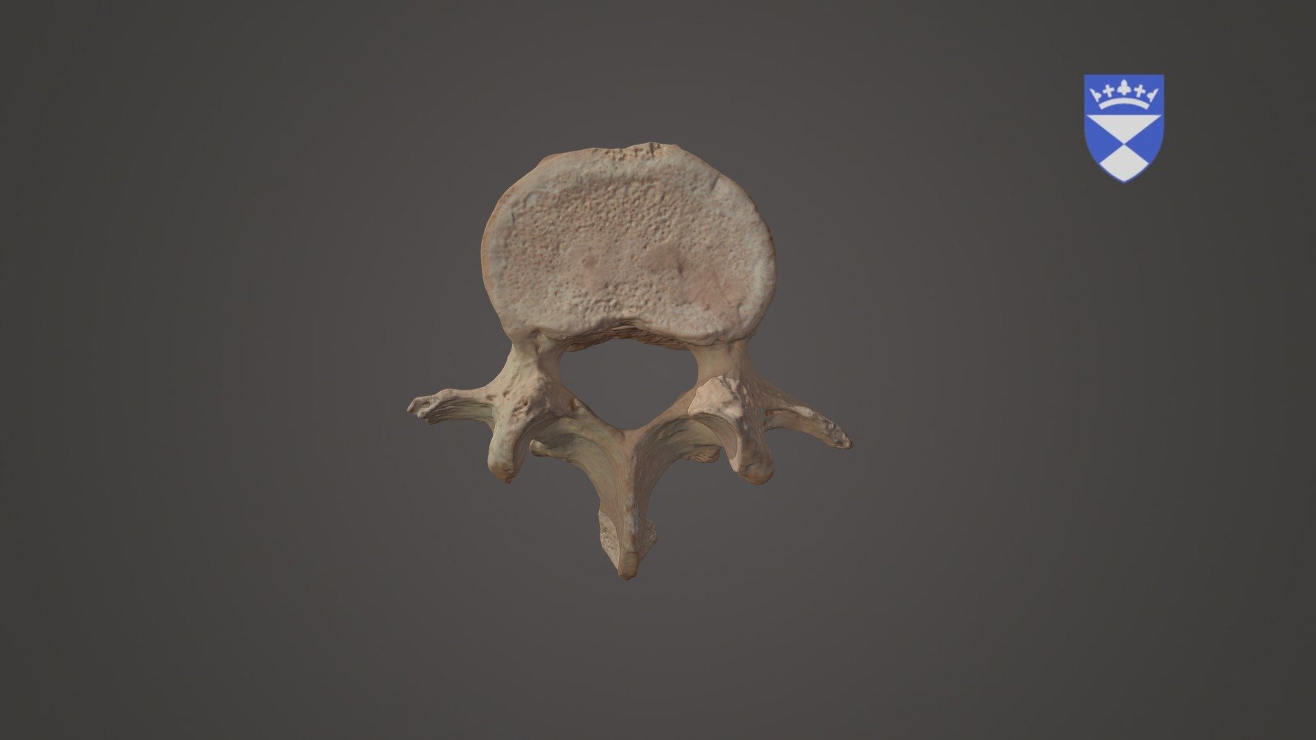 Lumbar Vertebra - 3D model by University of Dundee, CAHID (@anatomy ...
