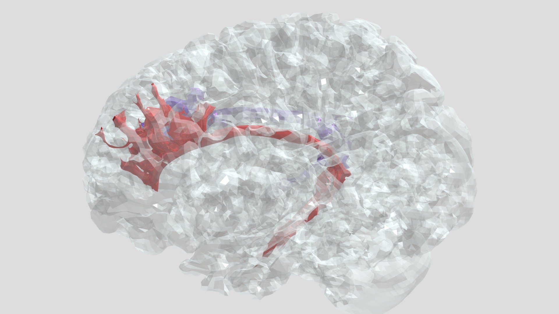 Your Cingulum Bundle - Download Free 3D model by 3D Neurosurgery ...
