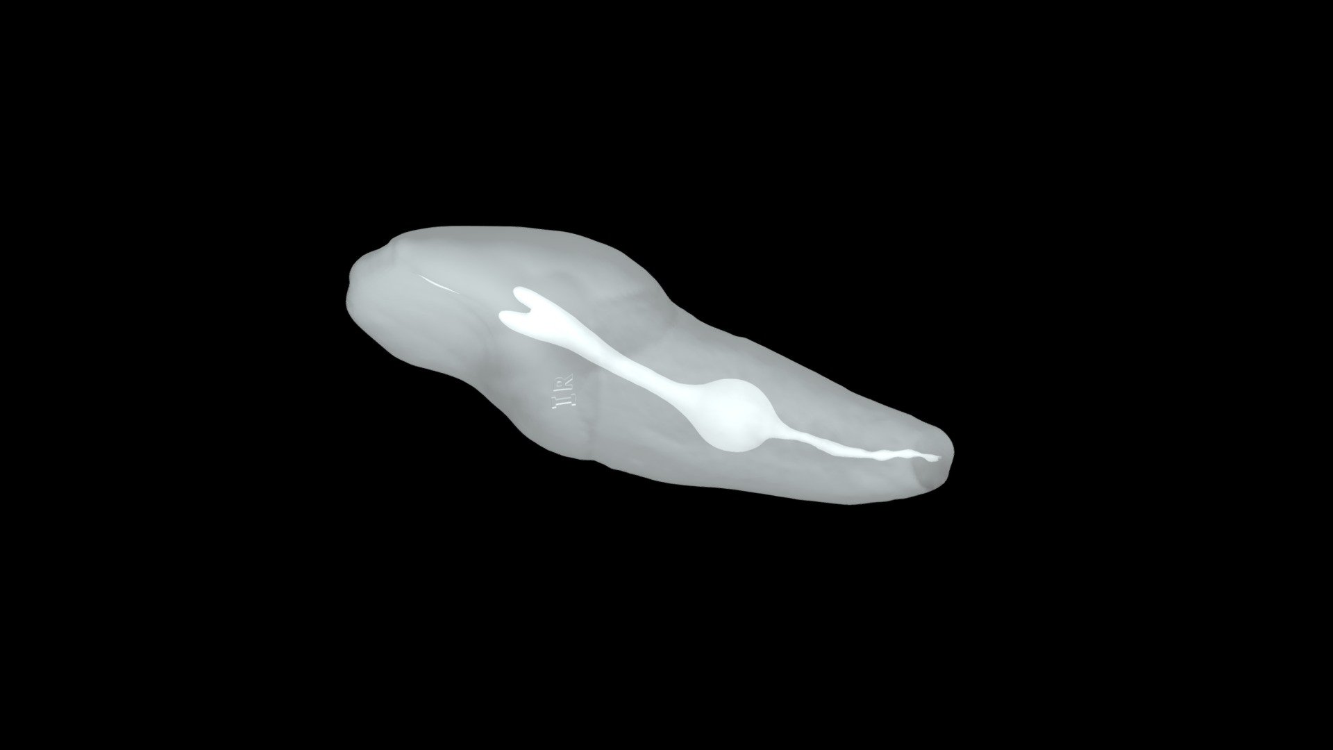 Tooth 9 Internal Resorptions - 3D model by biomed3d [018cb5c] - Sketchfab