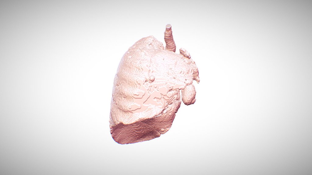 Lung - A 3D model collection by ames5529 - Sketchfab