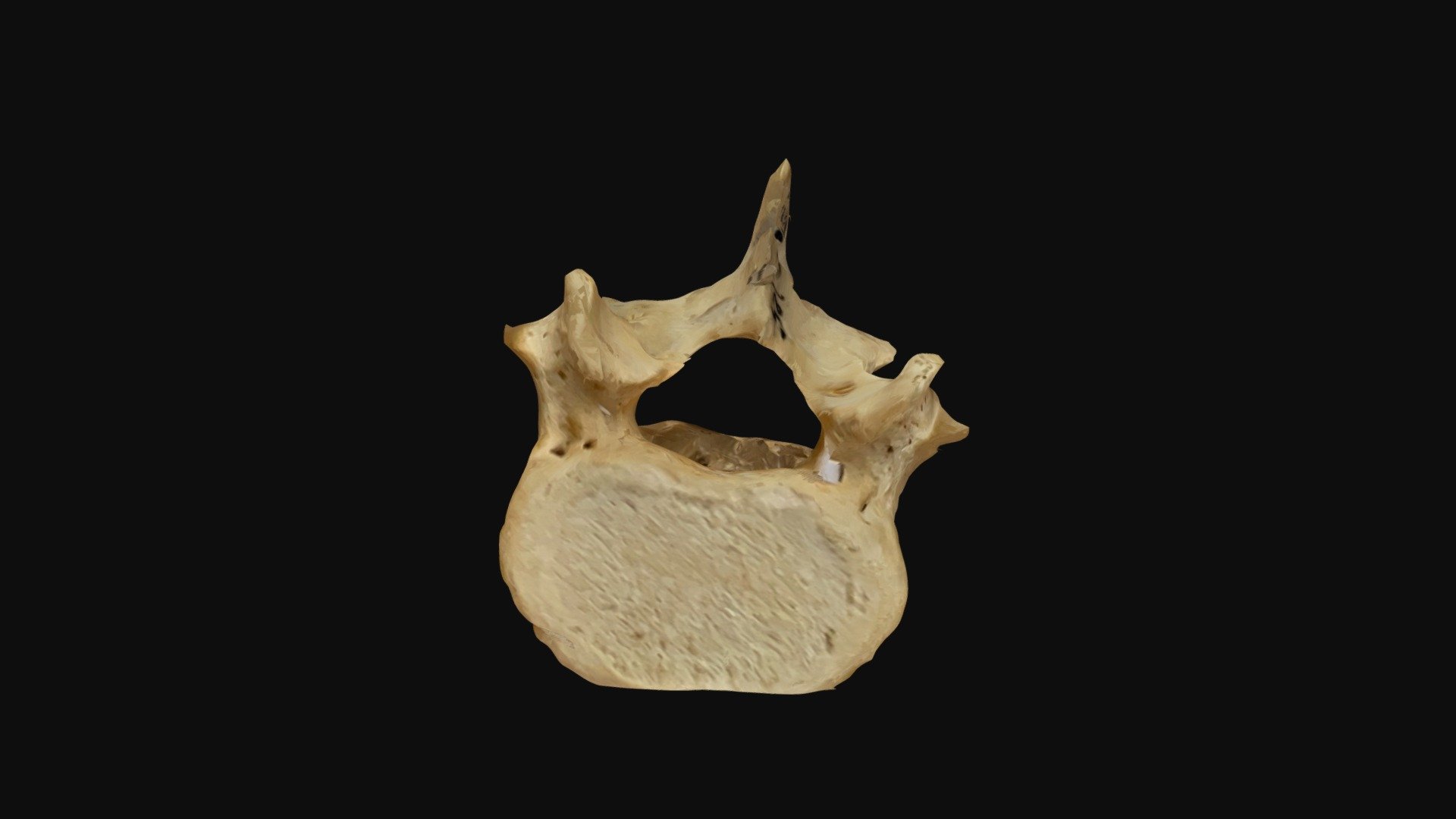 3rd Lumbar vertebra - 3D model by prajjawalit [01c6fe3] - Sketchfab
