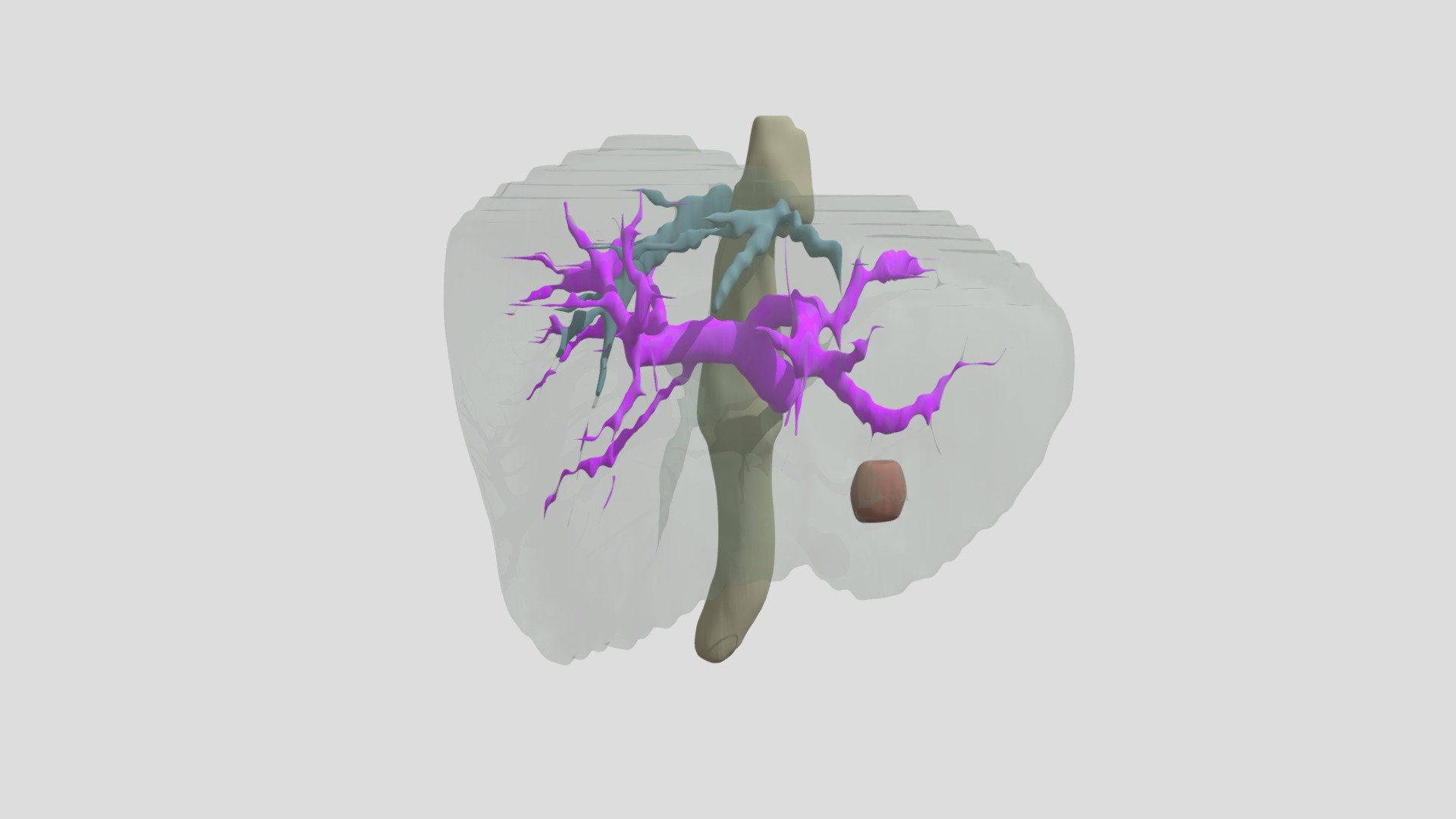Livseg_1020.nii.gz - 3D model by Keyur Radiya (@keyurradia) [02438d0 ...