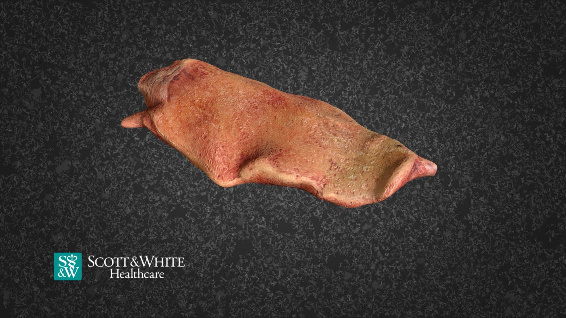Gallbladder 140465 - 3D model by Scott & White Moulage Project ...