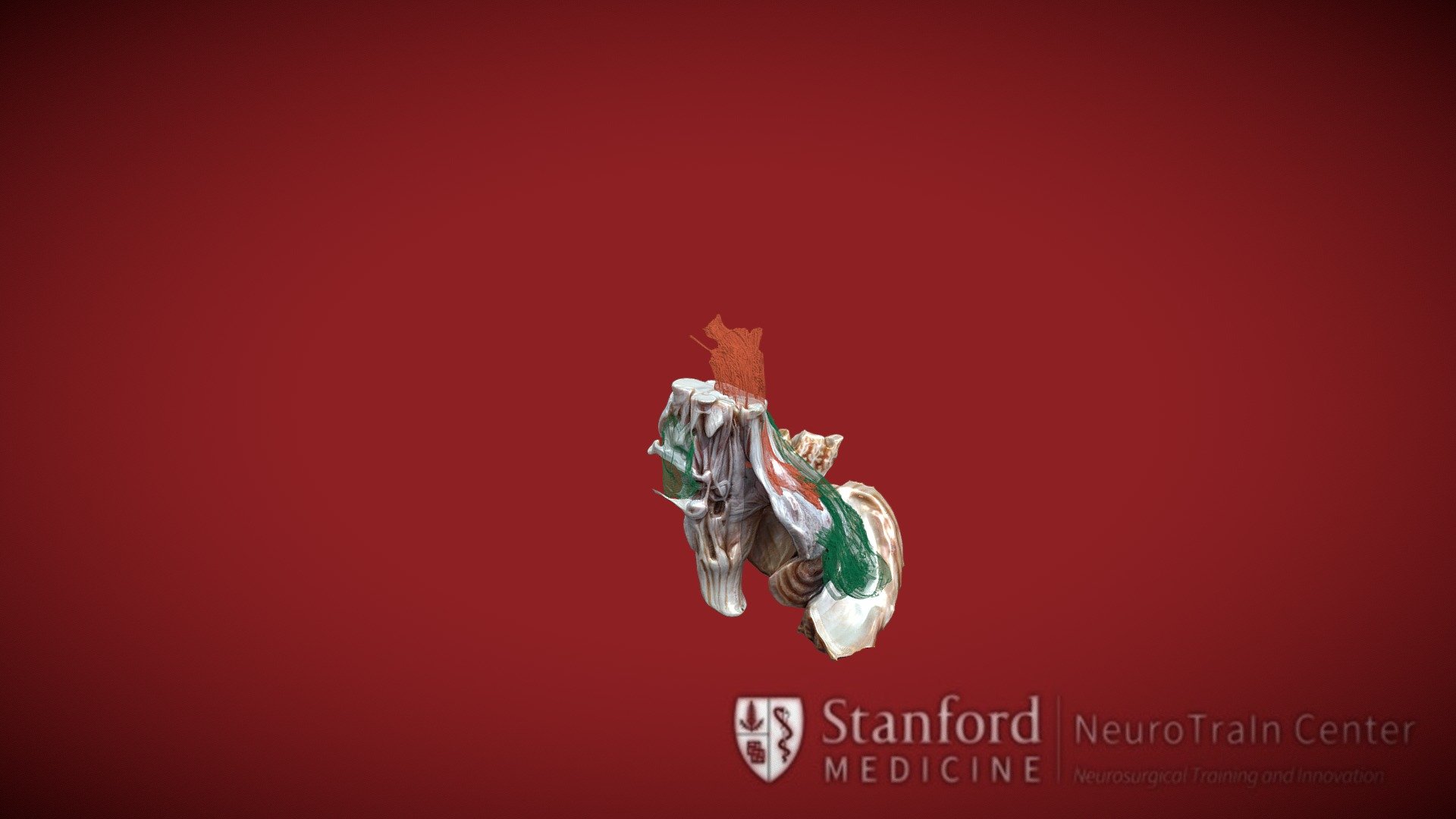 Superior and Inferior Cerebellar Peduncle - 3D model by vv (@verav ...