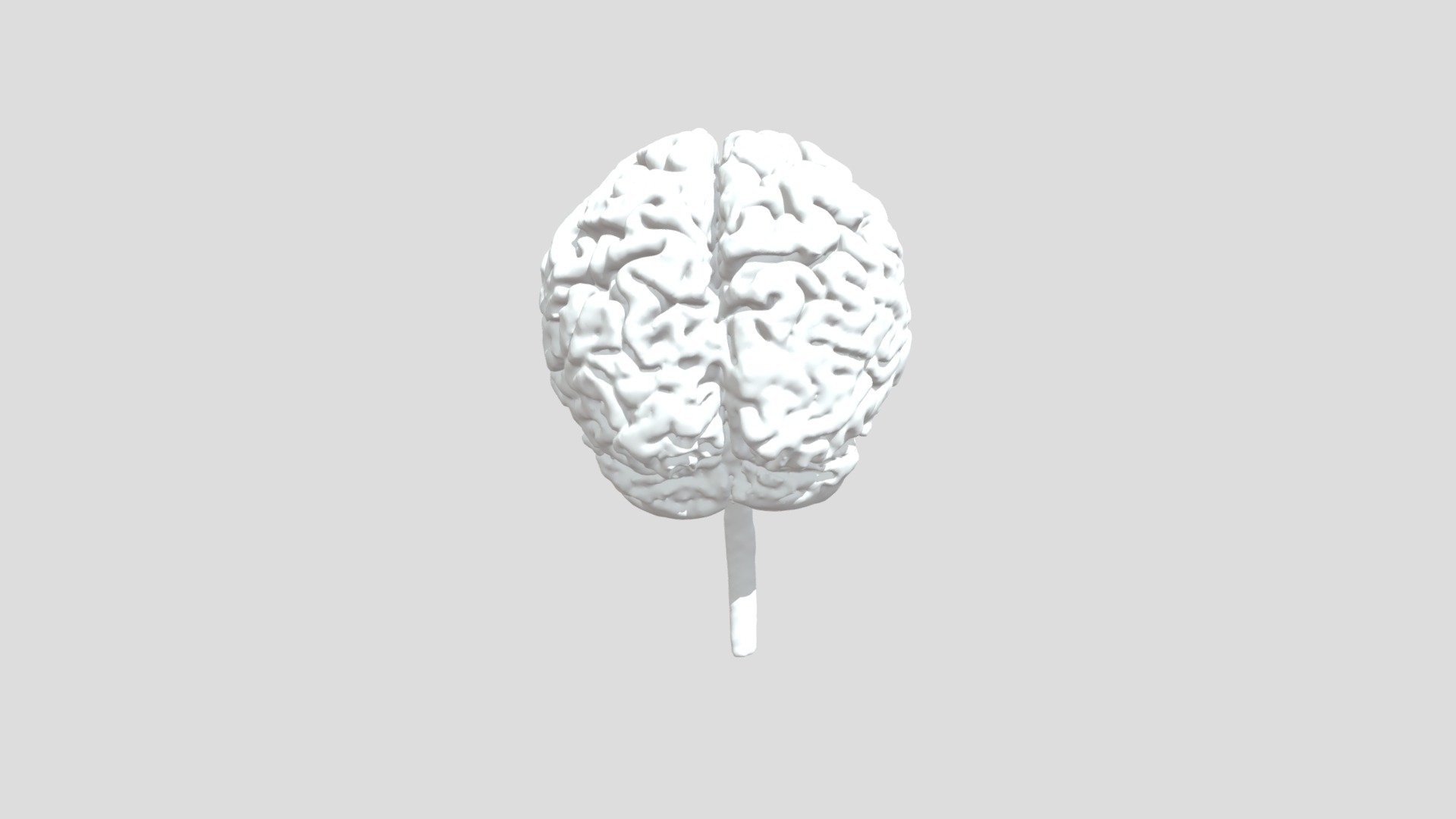 CT or MRI scans convert to 3d printable file - Download Free 3D model ...