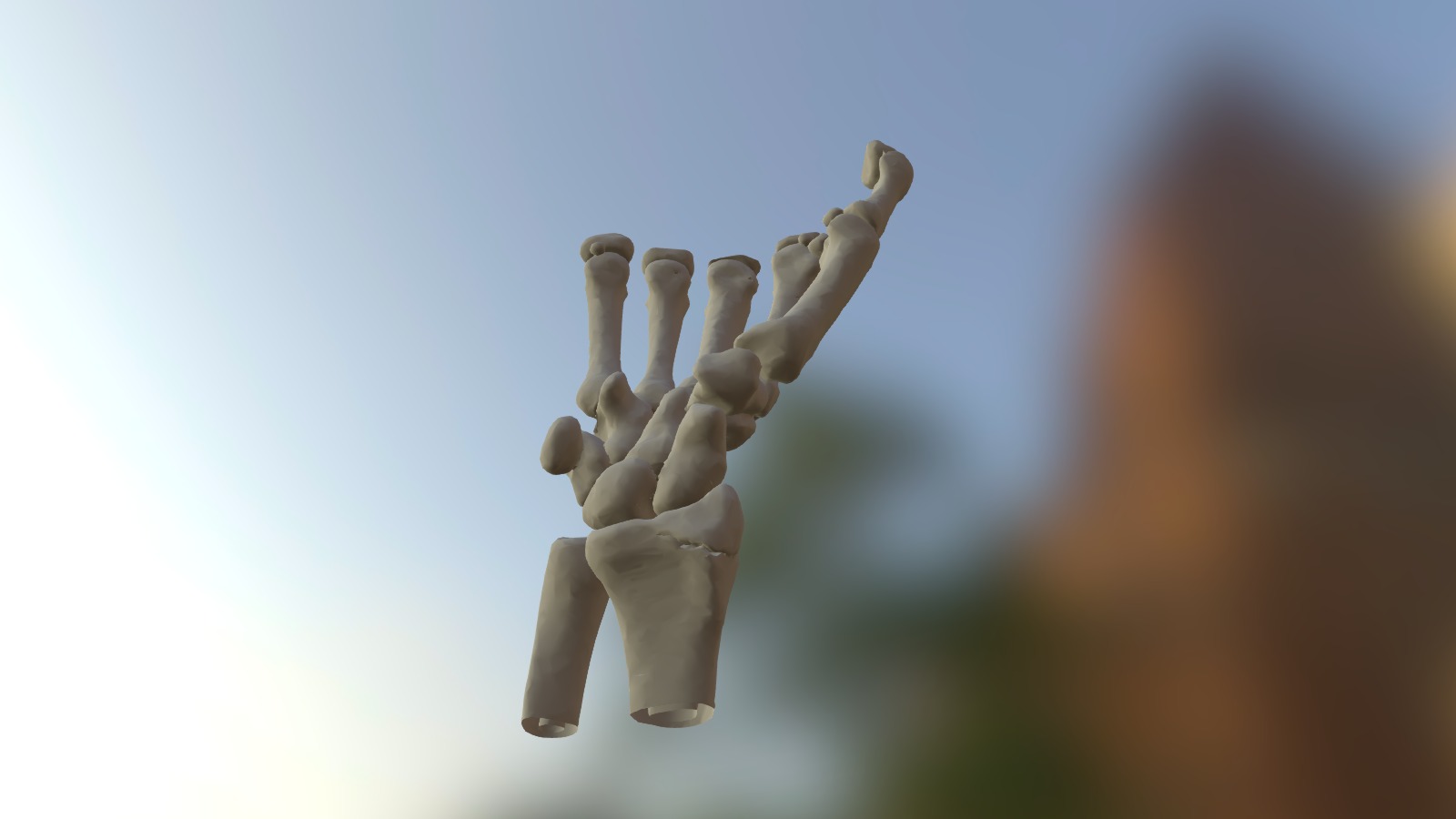 Wrist Fracture - sku252 - 3D model by orto3d [03886c9] - Sketchfab