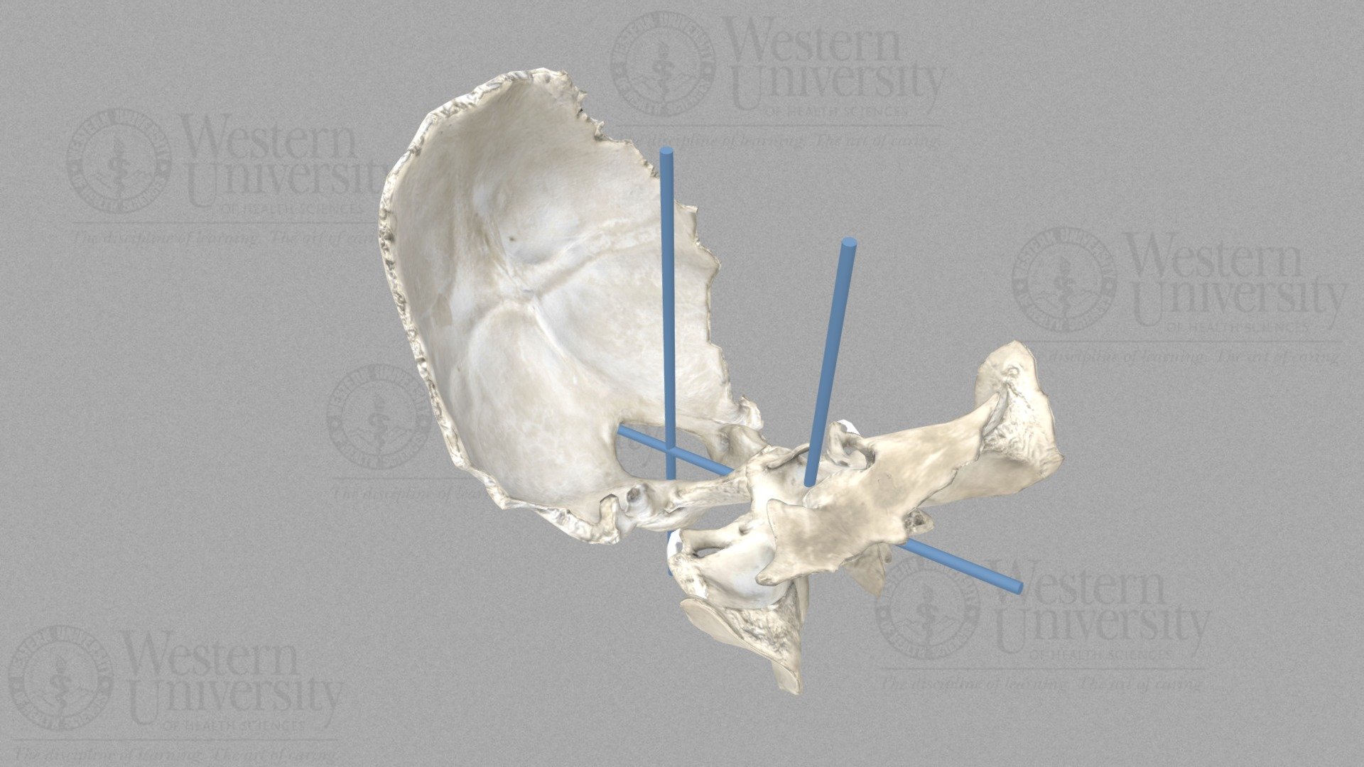 101-1 Left Sidebending Rotation Strain Pattern - 3D model by WesternU3D ...