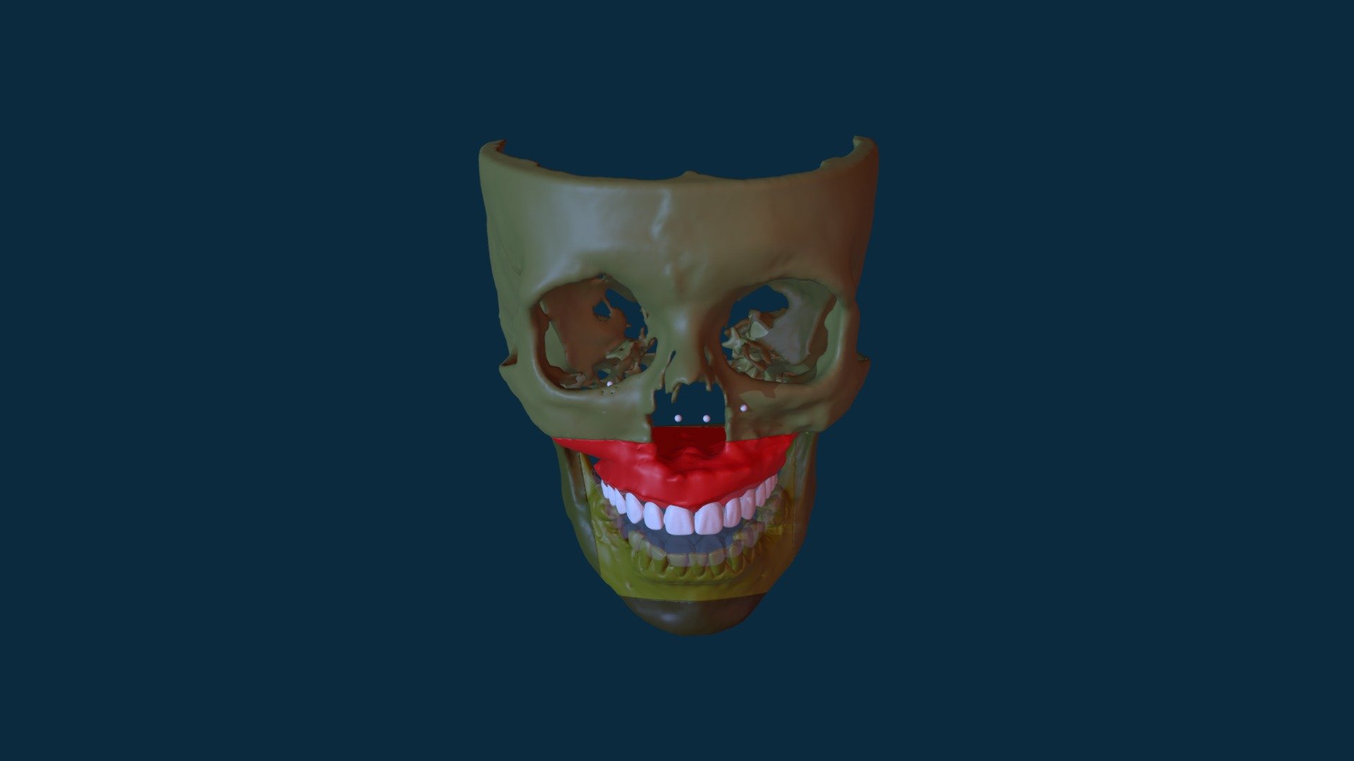 Planejamento Luzinete Rueda Baena - Dr. Carlini - 3D model by ...