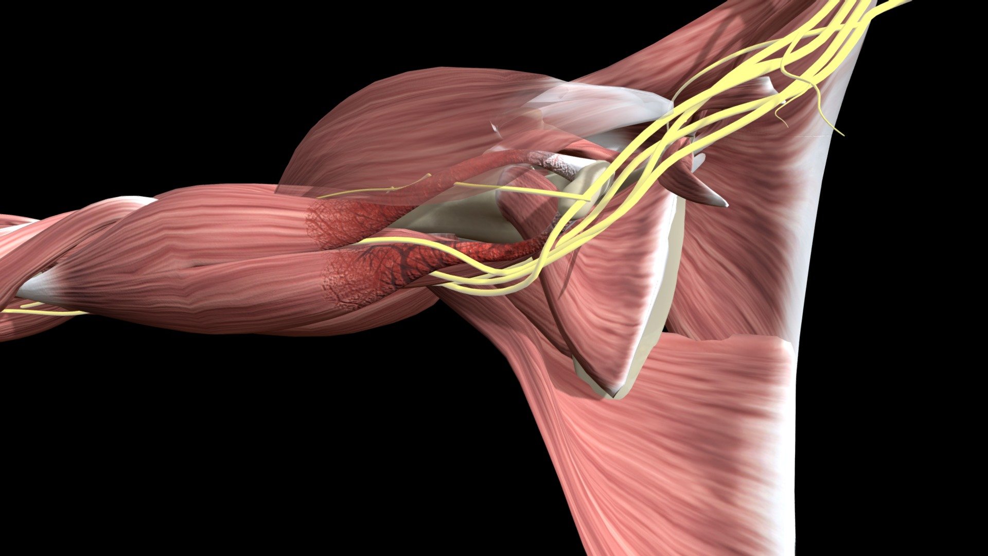 Biceps Tendonitis - 3D model by IU Indianapolis University Library ...
