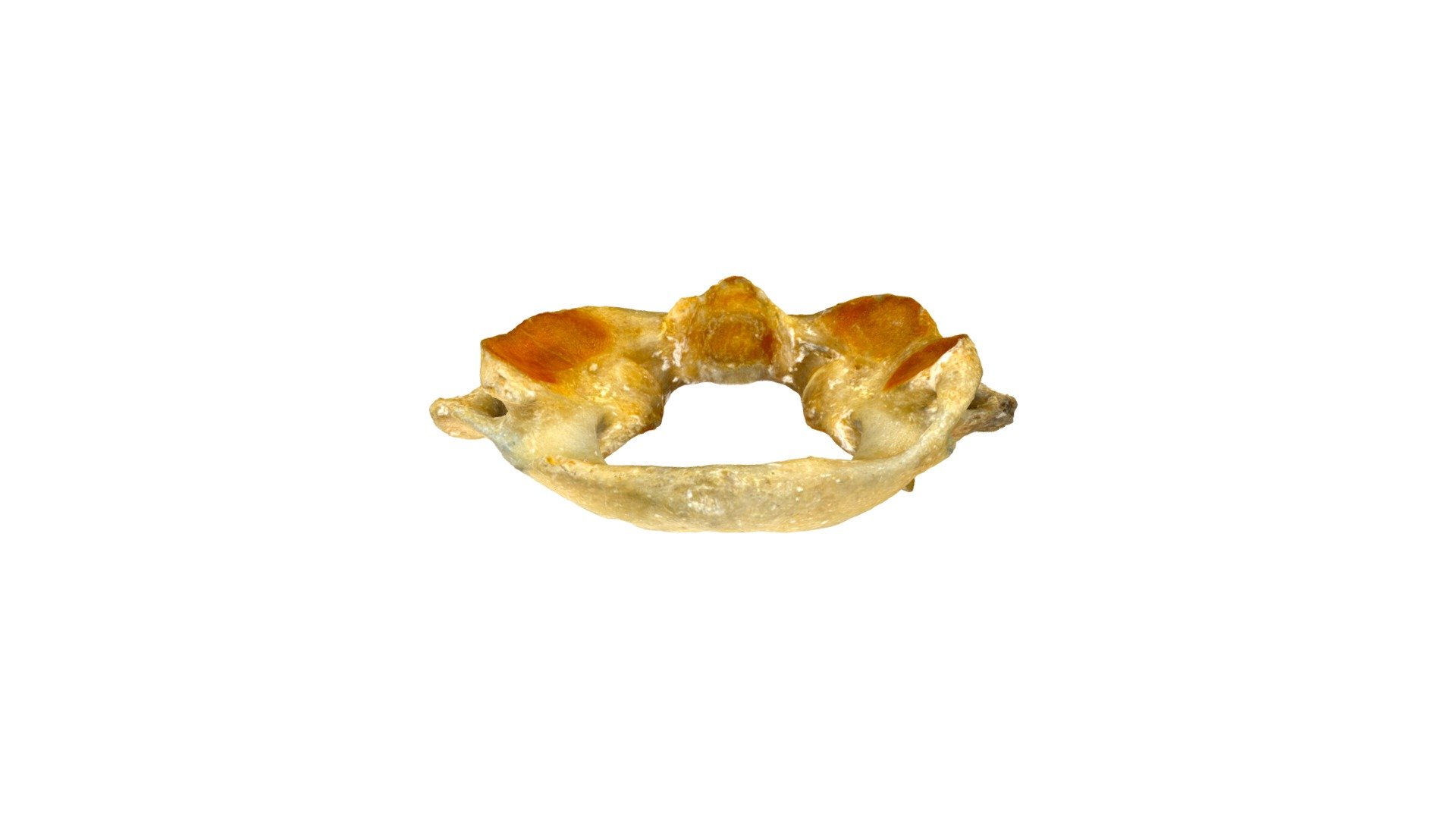 C1 Cervical Vertebra (Atlas) - 3D model by mozgury [04d1511] - Sketchfab