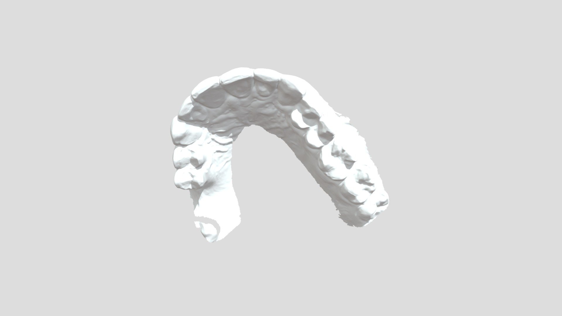 ابراهيم Upper Jaw Scan - 3D model by almuna dental center ...
