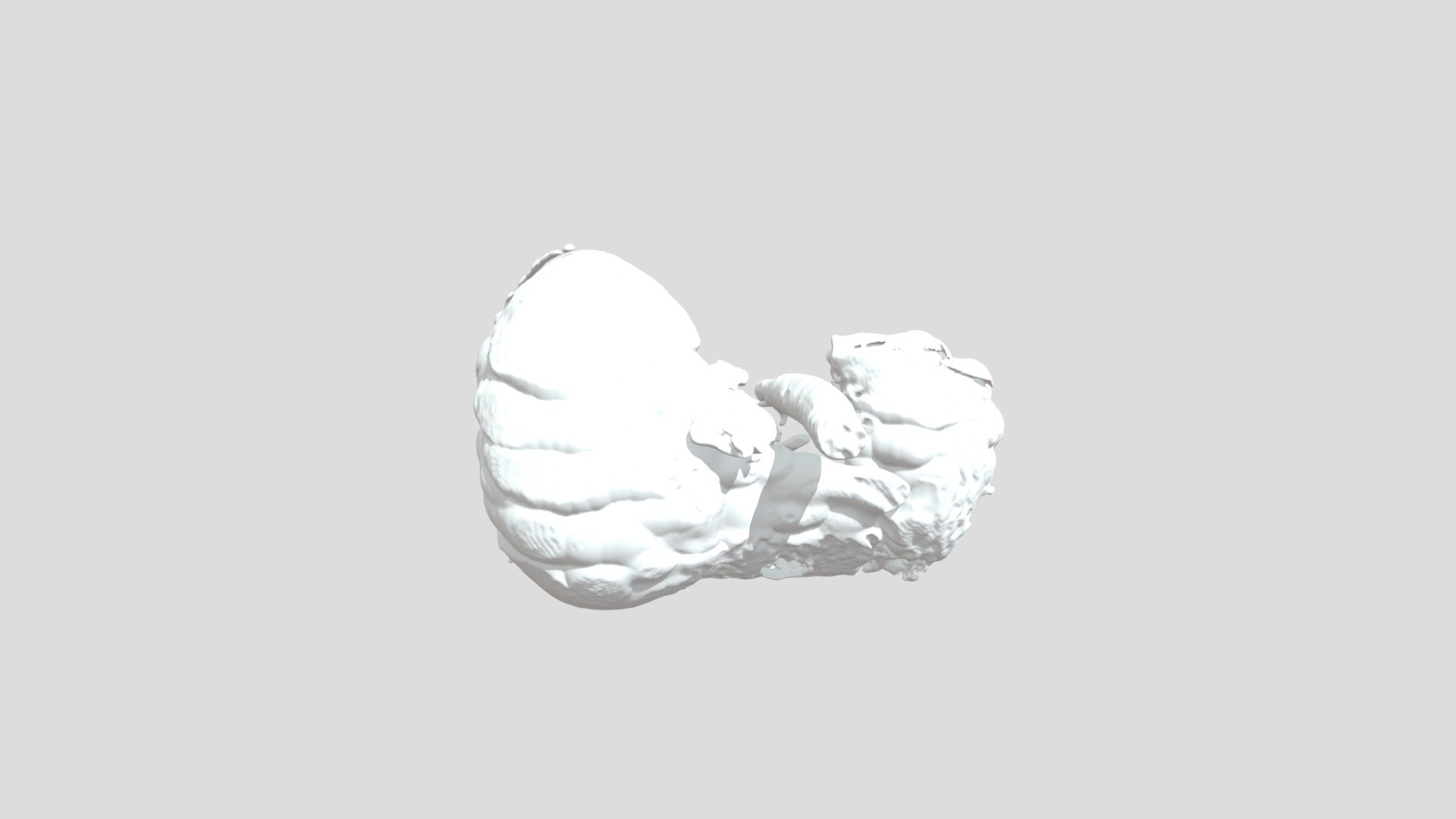 MRCP2 - Download Free 3D model by Rays.VR [05cfe0c] - Sketchfab