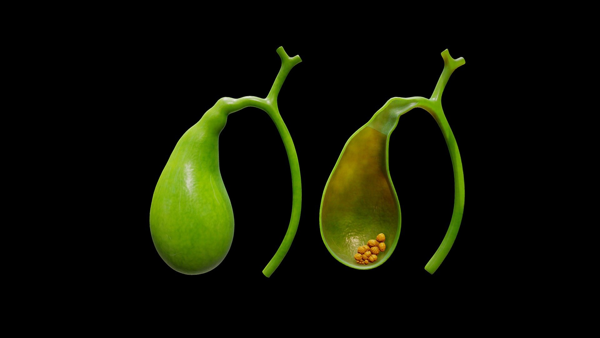 Gallbladder and Gallbladder Cross Section - Buy Royalty Free 3D model ...