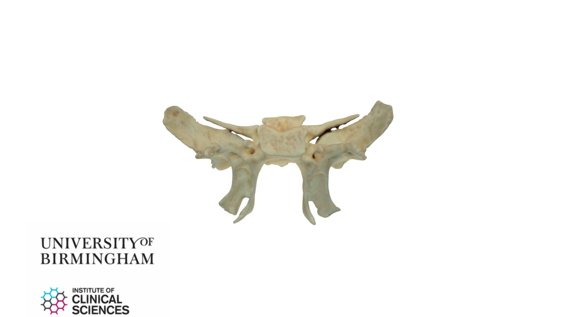 Sphenoid bone (isolated) - 3D model by UoB_Anatomy [0626b88] - Sketchfab
