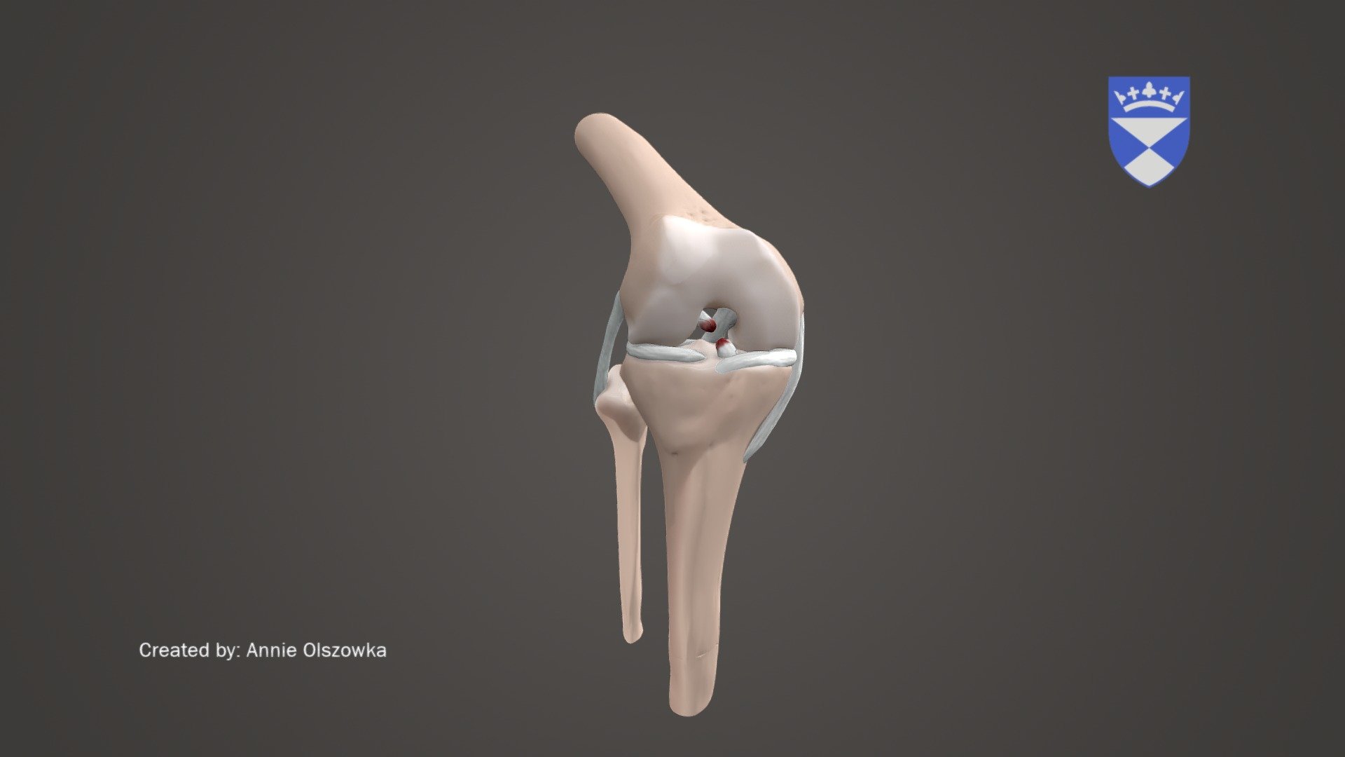Ruptured ACL - 3D model by University of Dundee, CAHID (@anatomy_dundee) [065e869] - Sketchfab