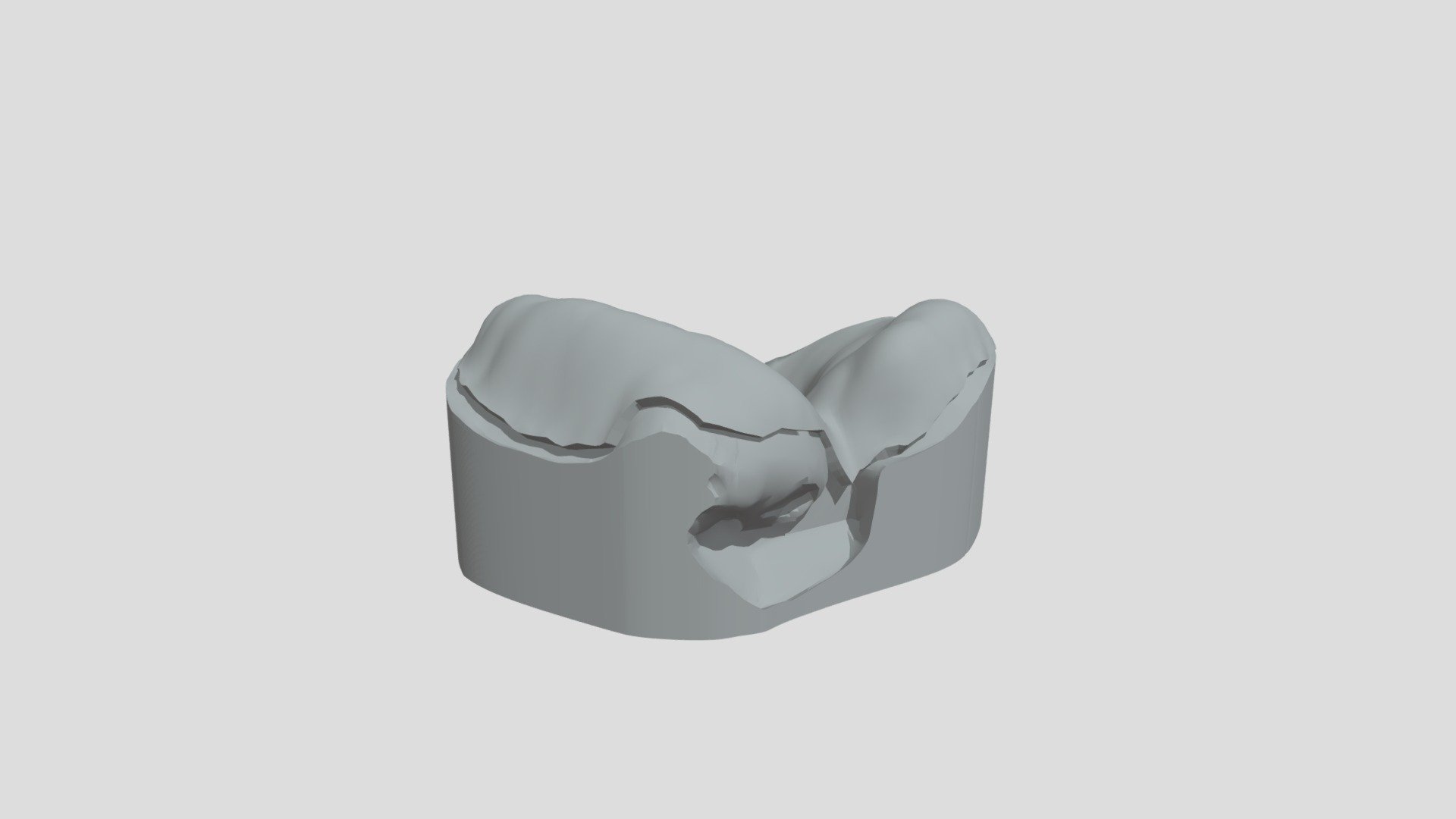 Cleft Palate With Model - 3D model by Joshua Lee (@JoshuaLee) [06930cf ...