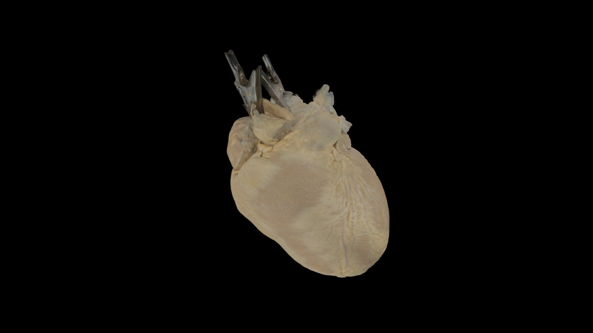 Human Heart Donation #102 - Download Free 3D model by VisibleHeartLabs ...
