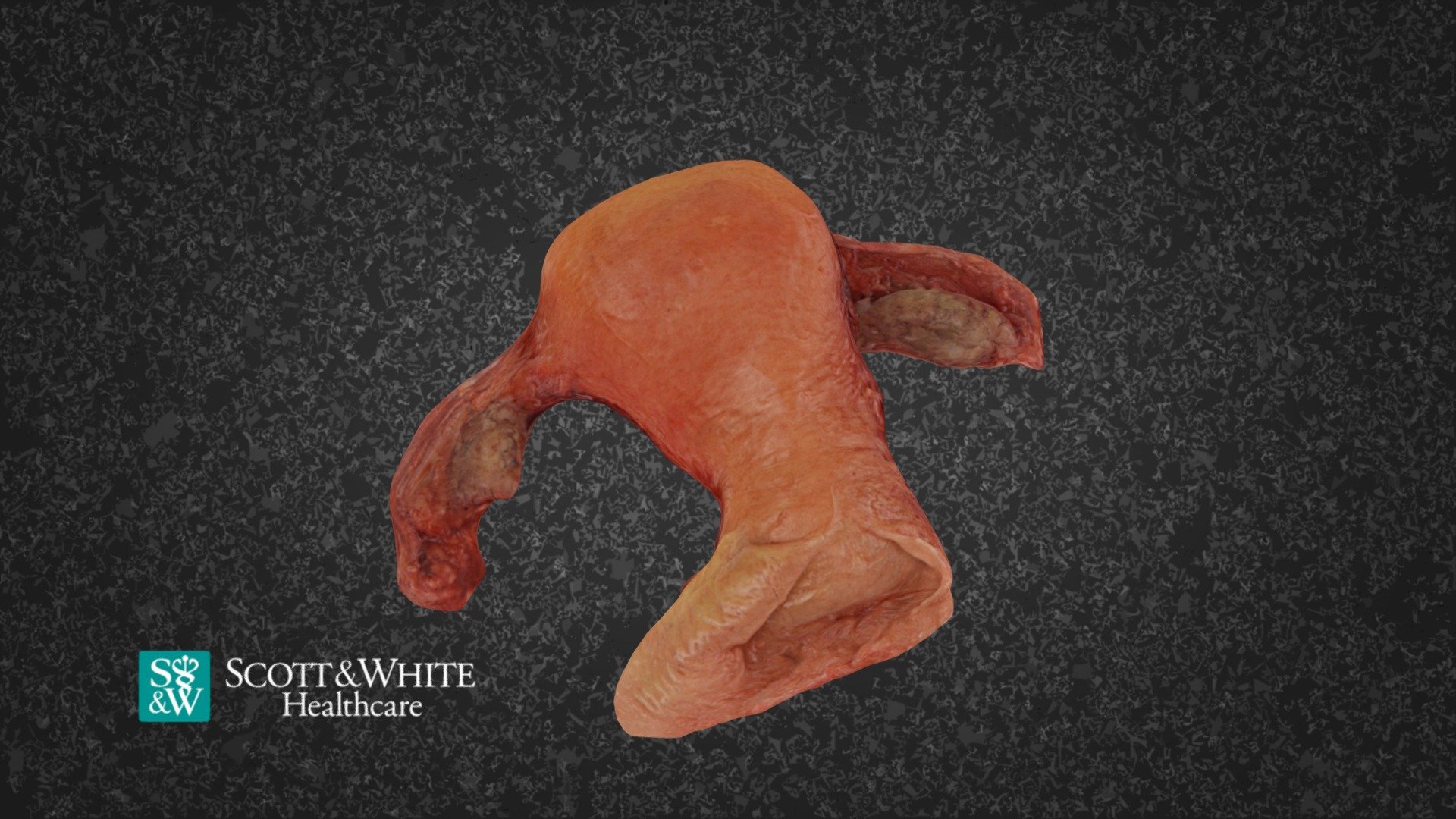 Tubes Ovaries Uterus Cervix - 3D model by Scott & White Moulage Project ...