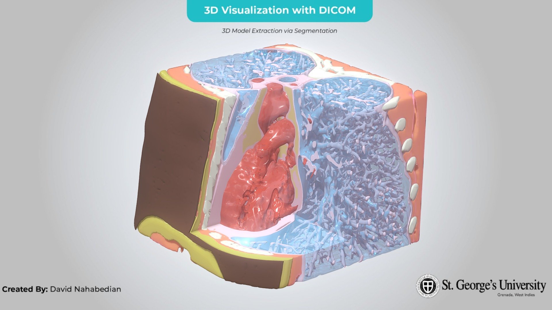 Thoracic Cavity Anatomy - DICOM Extraction - 3D model by The Center for ...