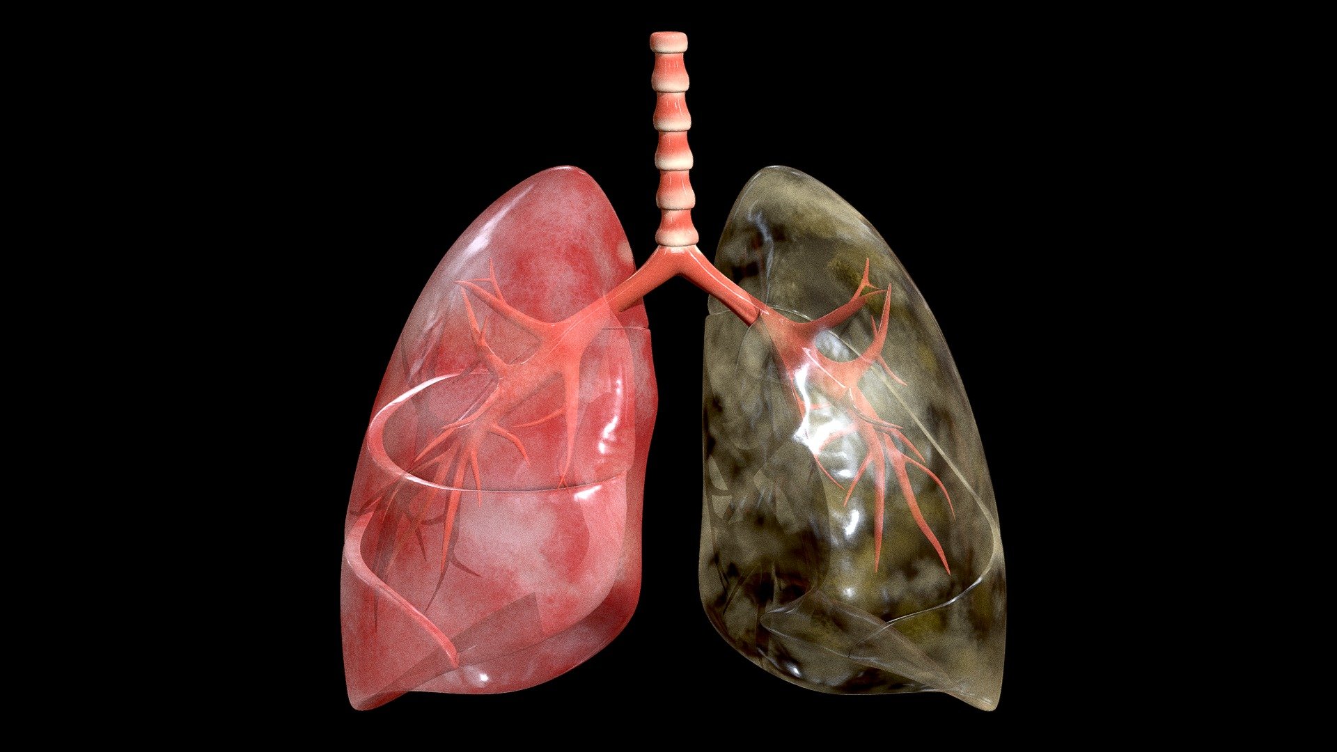 Smoker's Lungs VS Non-smoker's lungs - 3D model by arloopa [0808cb4 ...
