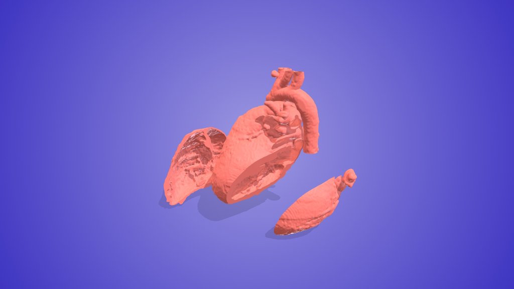 Normal Hearts - A 3D model collection by 3D Heart Project ...