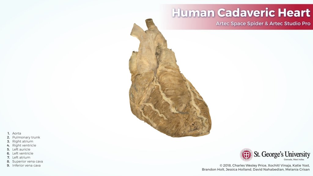 Human Anatomy - A 3D model collection by The Center for BioMedical Visualization at SGU ...