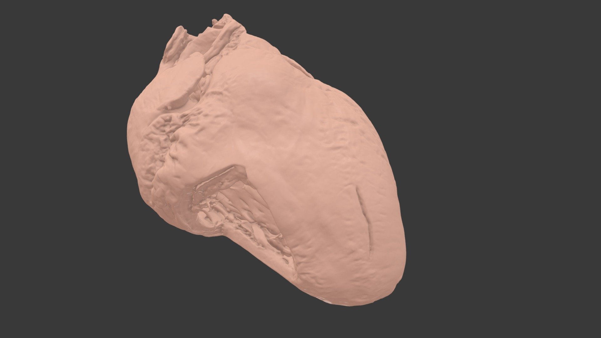 PFO #1 - PFO, DCRV, hypo RV - 3D model by heartmodels [0876602] - Sketchfab