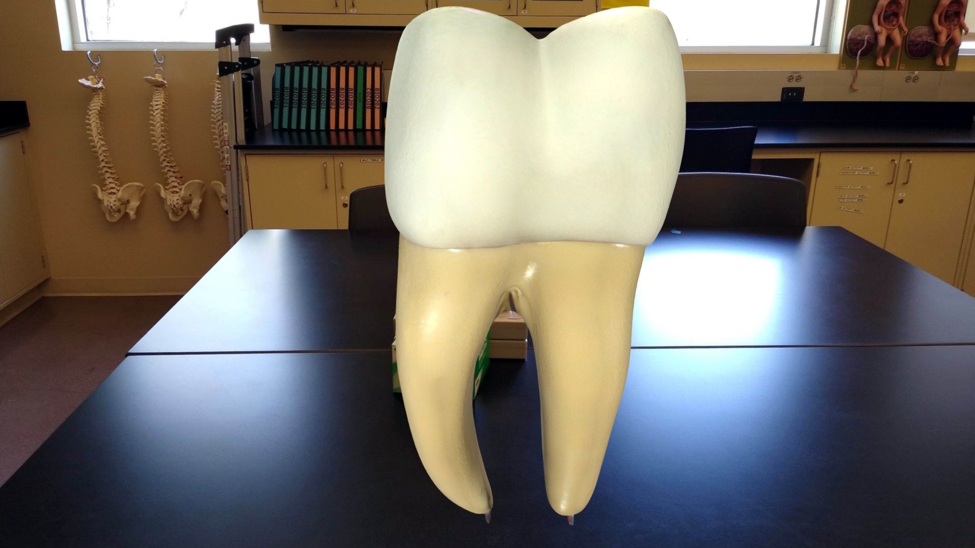 human tooth - 3D model by Dr. Alex Cheroske (@aquaman27) [089e882 ...