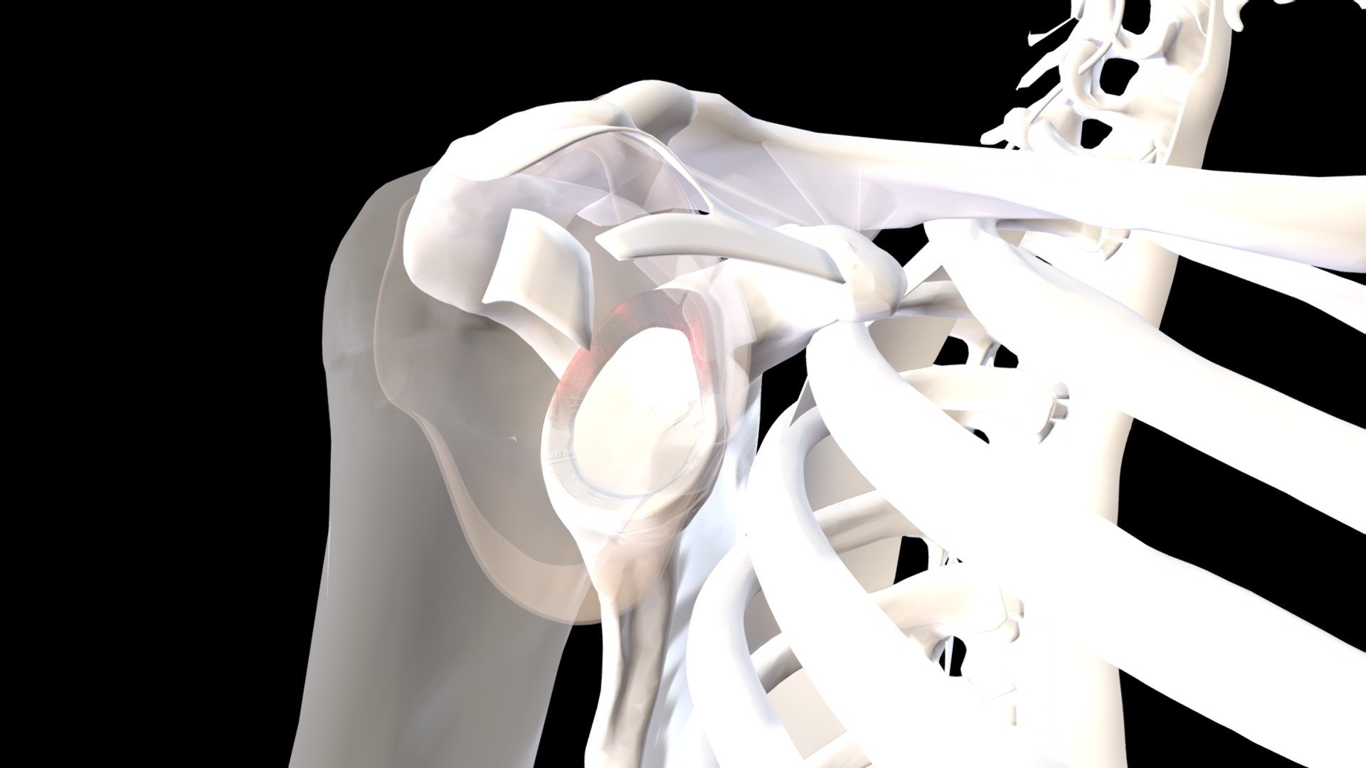 Glenoid-Labral Tear - 3D model by Znyth Technologies (@znyth) [08cac47 ...