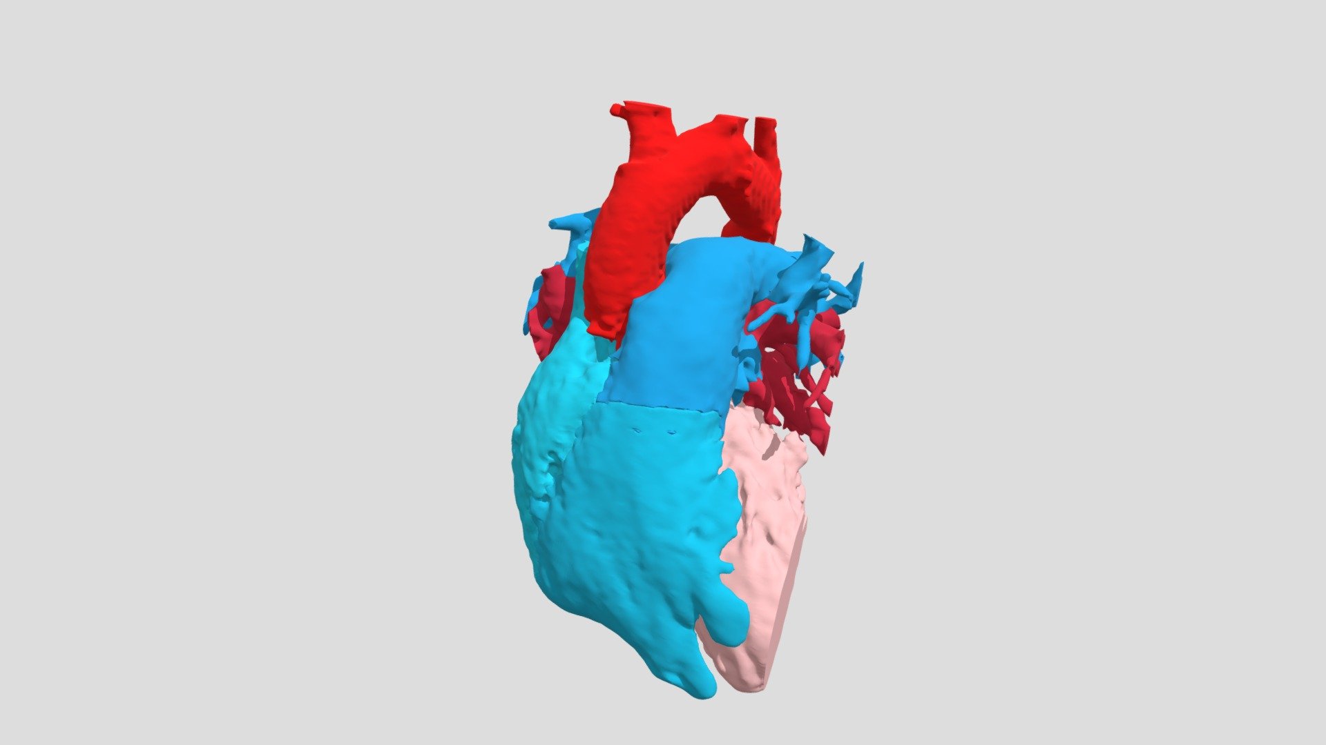 Ascending Aorta, Aortic Coarctation (S0346) - 3D model by NCH Advanced ...