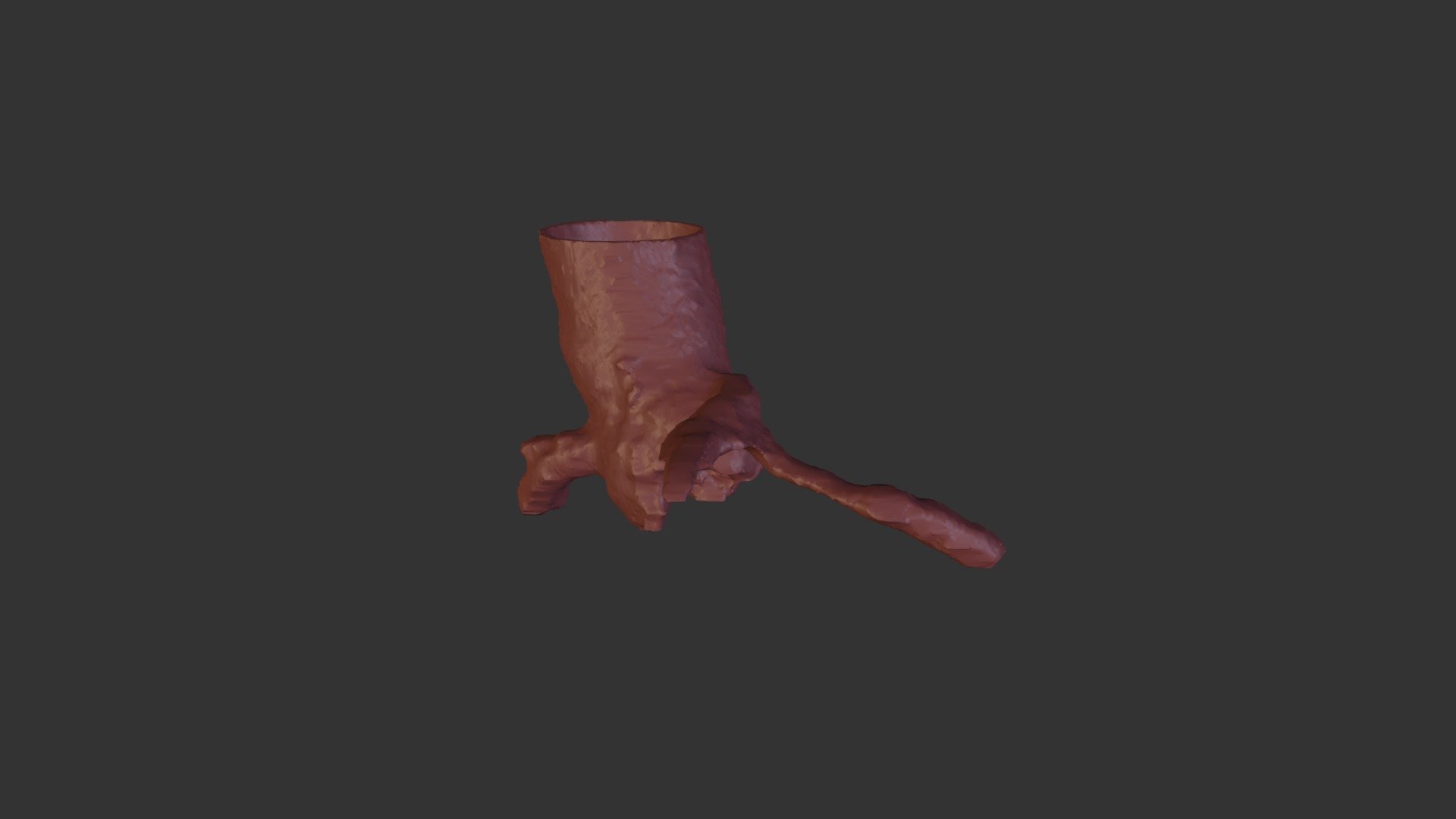 Artery - 3D model by EYBioD [091bfd4] - Sketchfab