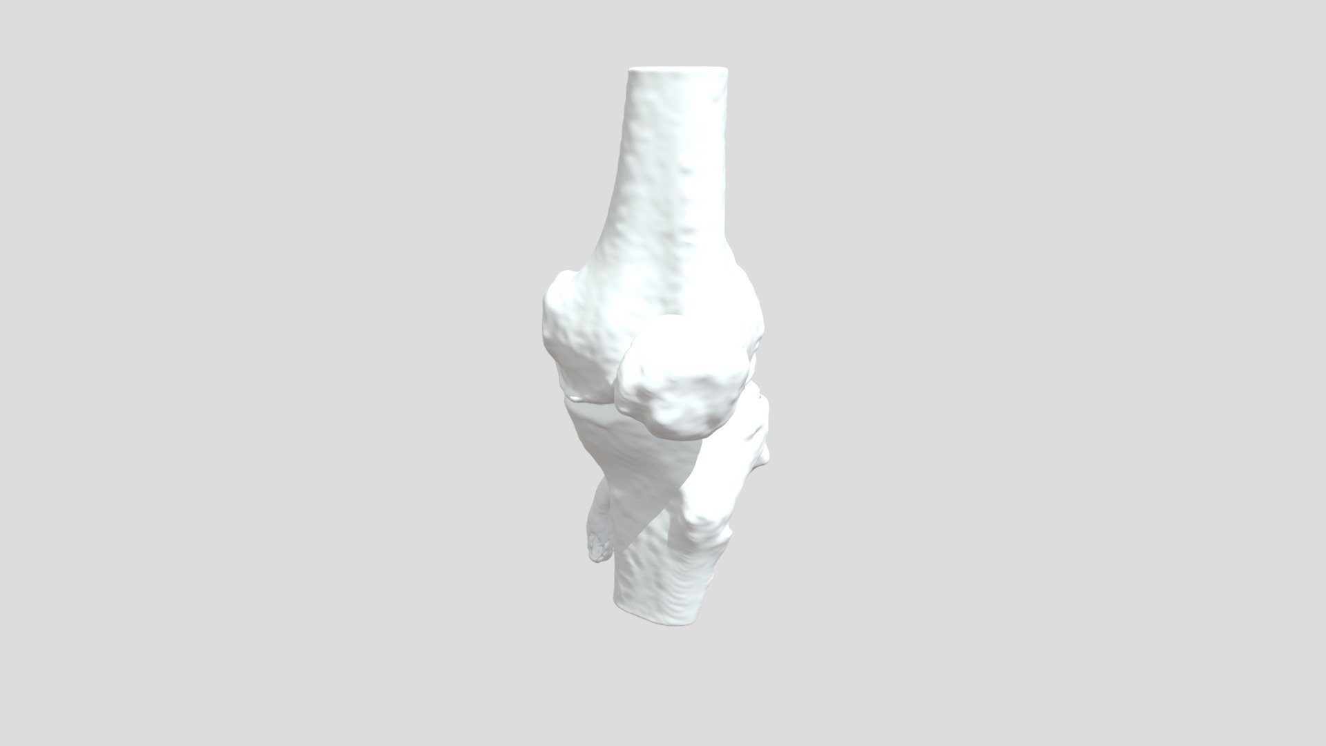 Segmentation Prd Ach Lt Bone - 3D model by curisdata.science [098b33a ...