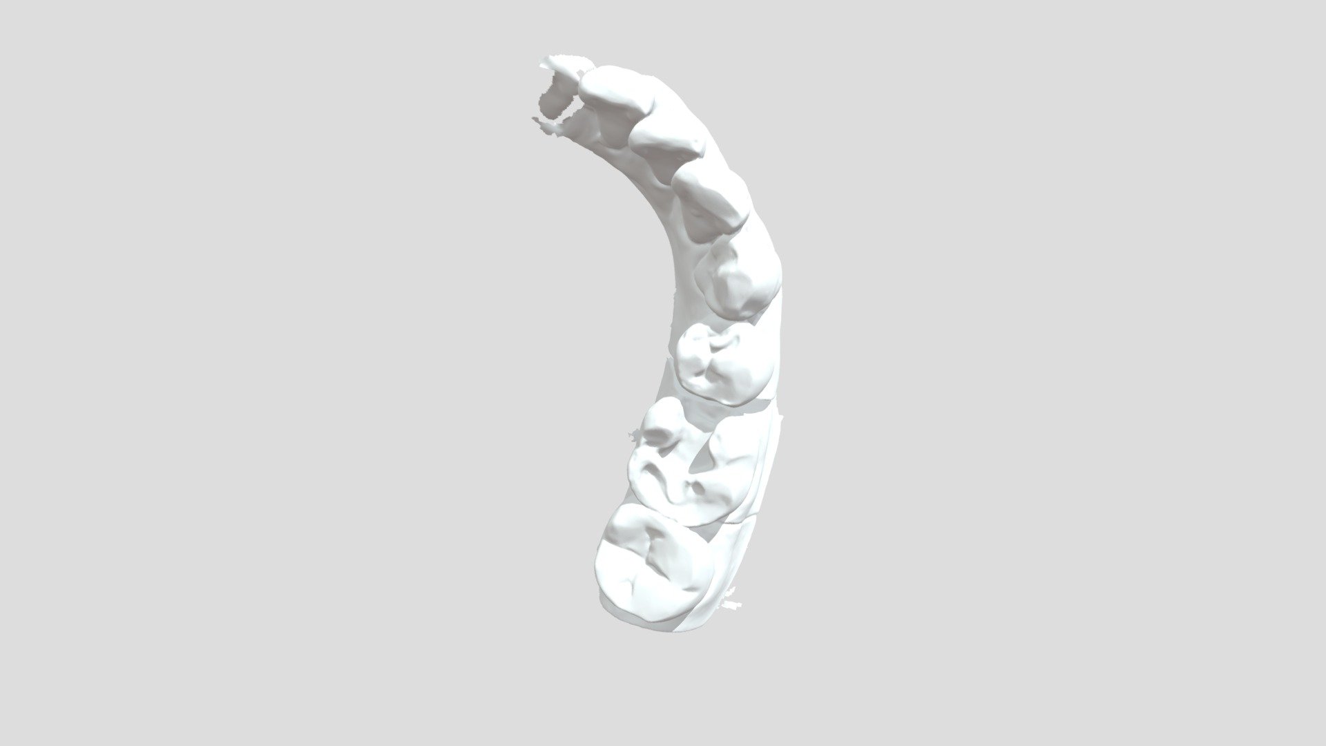 46 Inlay MO Upper Jaw Scan - 3D model by crybrant [09d26dc] - Sketchfab