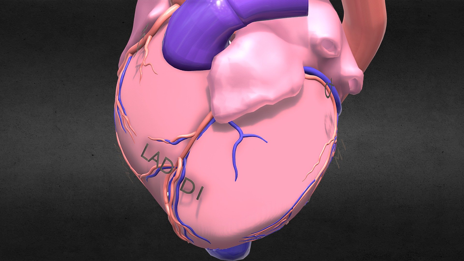 Coronary perfusion from showmethepocus.com - 3D model by showmethepocus ...