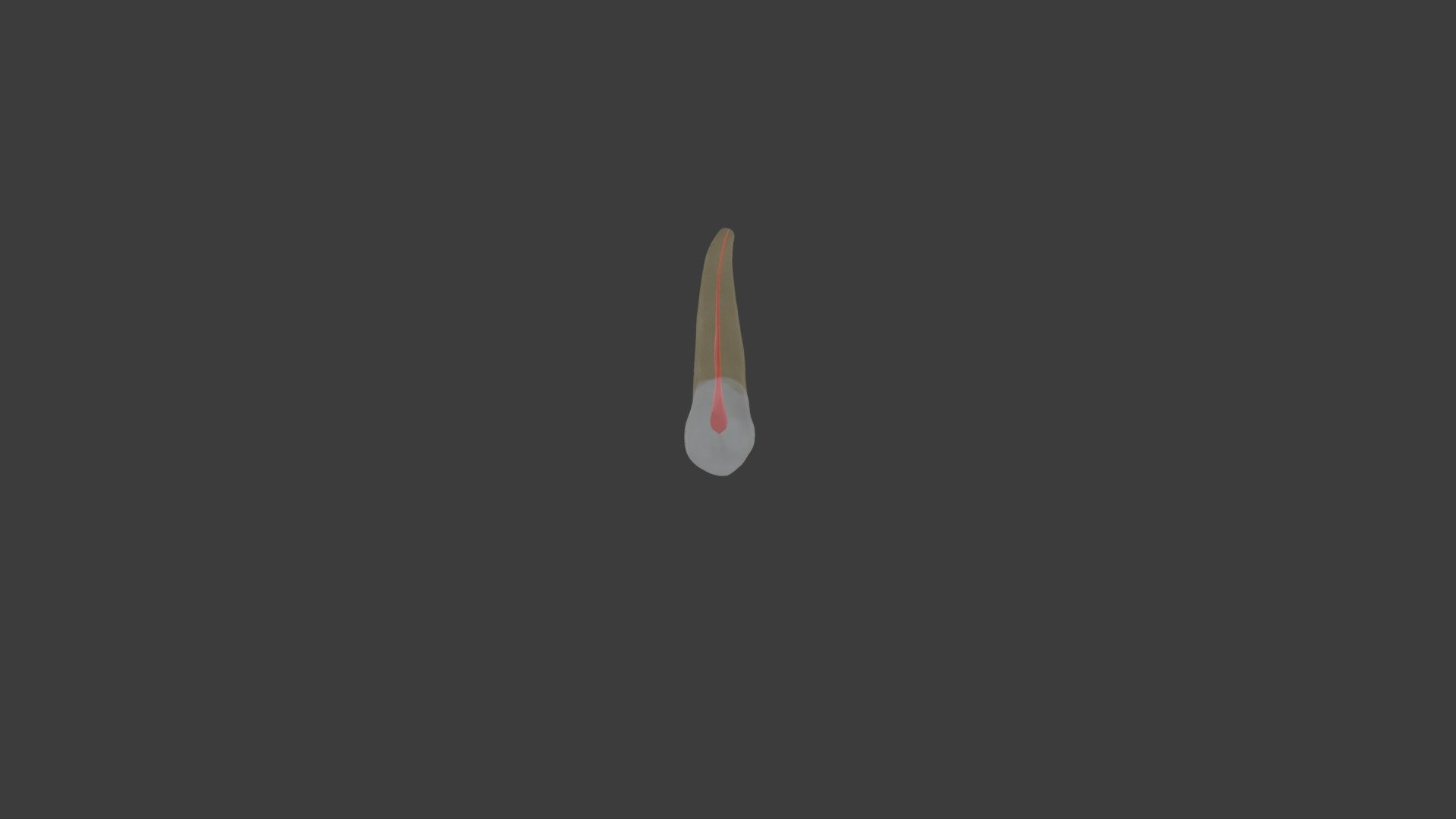 Maxillary Canine RCA - 3D model by Ahmed Mahrous (@drahedmahrous ...