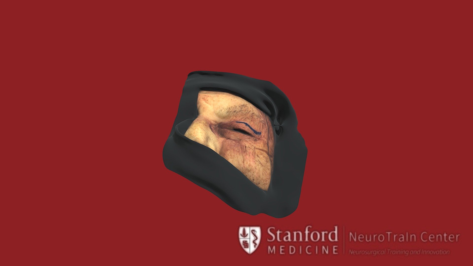 Step 1 - Skin Incision - 3D model by vv (@verav) [0aa01a3] - Sketchfab