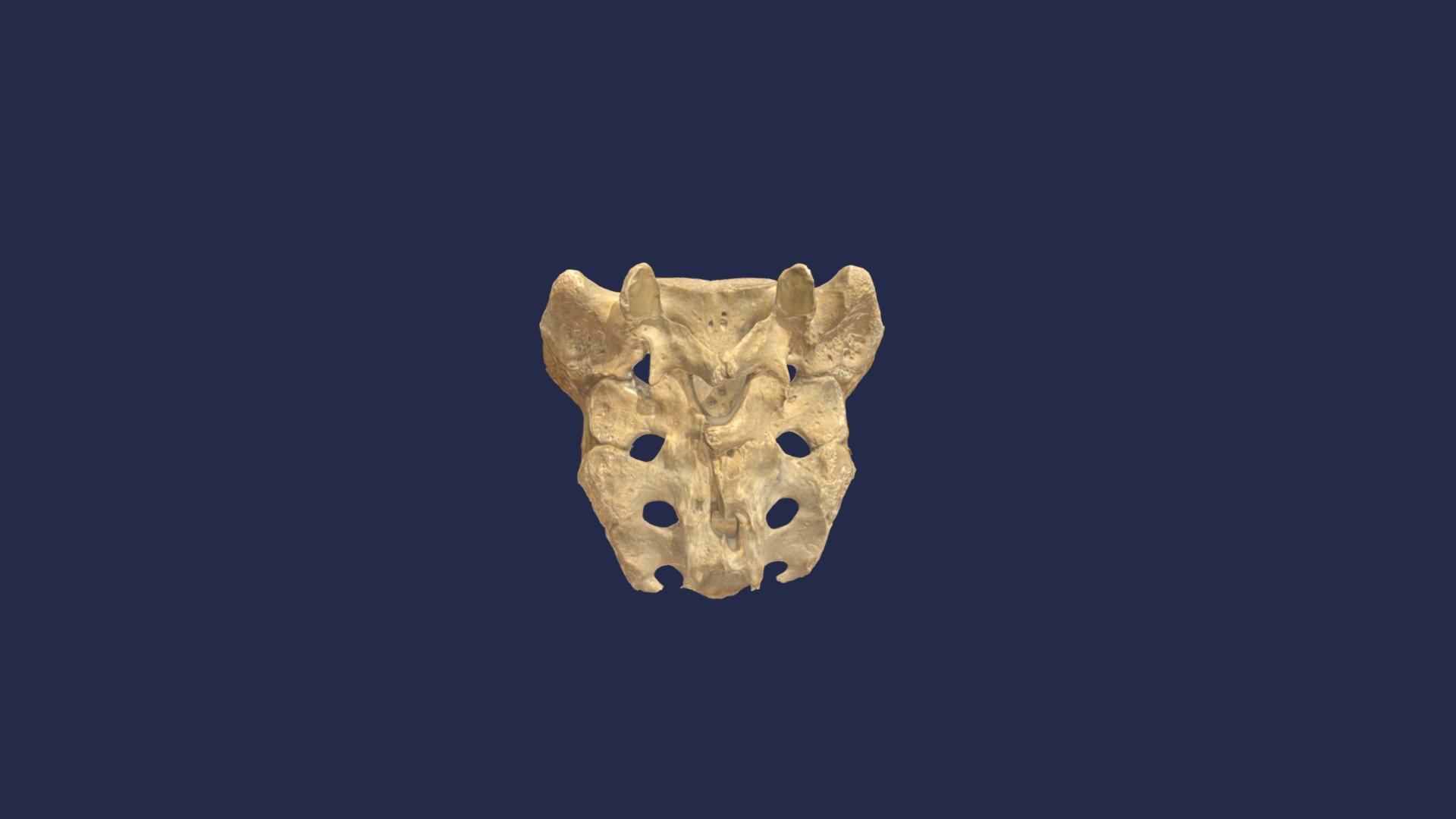 Os sacrum (Spina bifida) - 3D model by Institute of Anatomy Rostock ...