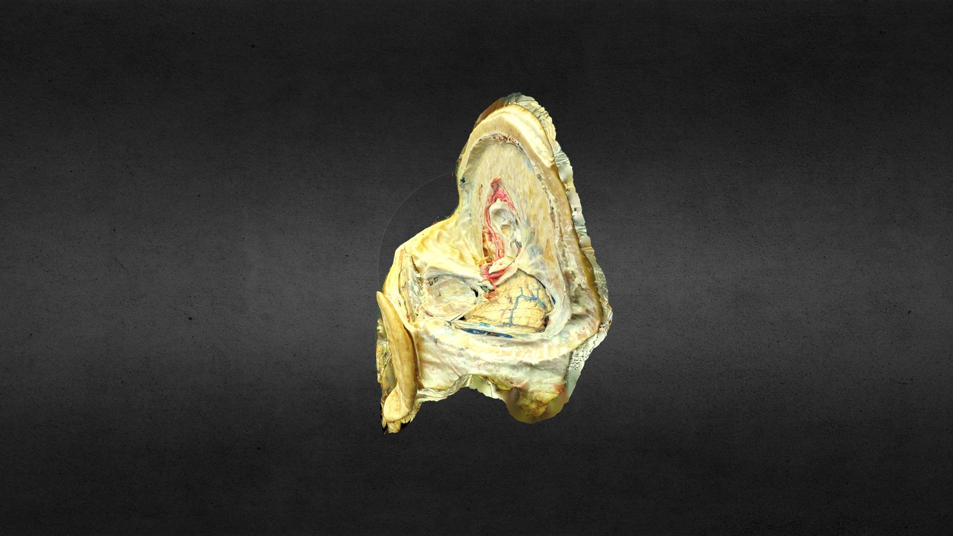 Cavernous Sinus and Falx - 3D model by vv (@verav) [0afe4cb] - Sketchfab