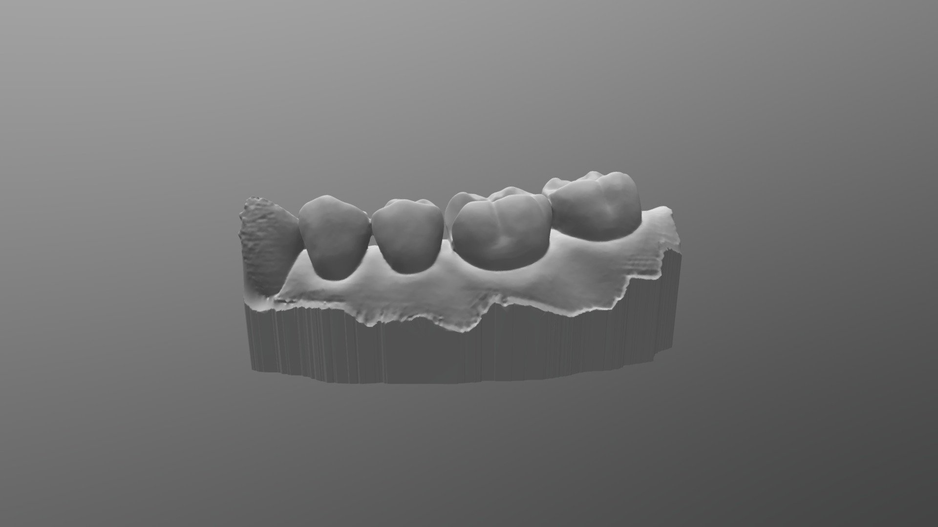 Inlay - 3D model by Tony Mennito (@mennitoa) [0b17d2f] - Sketchfab