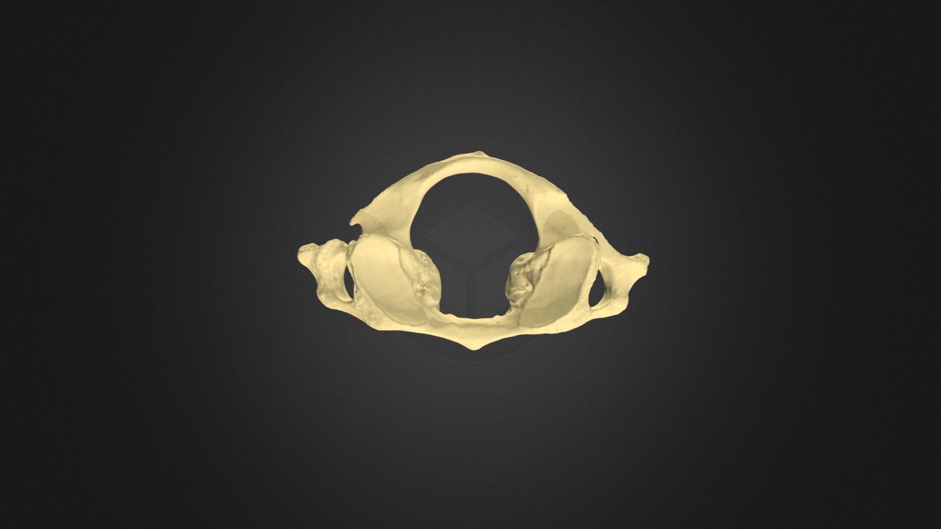 C1 Vertebra - 3D model by UBC Medicine - Educational Media [0c4a739 ...