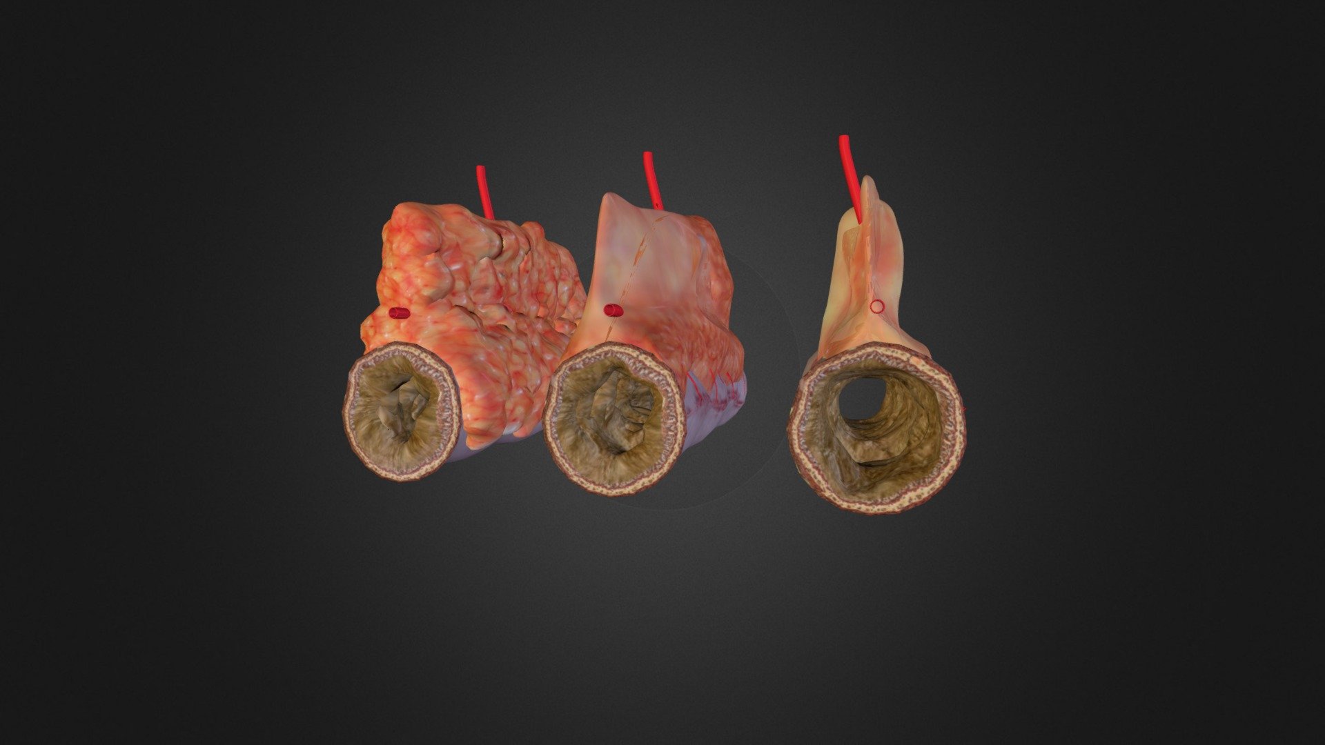 Fat Wrapping - 3D model by Dara Walsh (@darawalsh) [0c65e2a] - Sketchfab