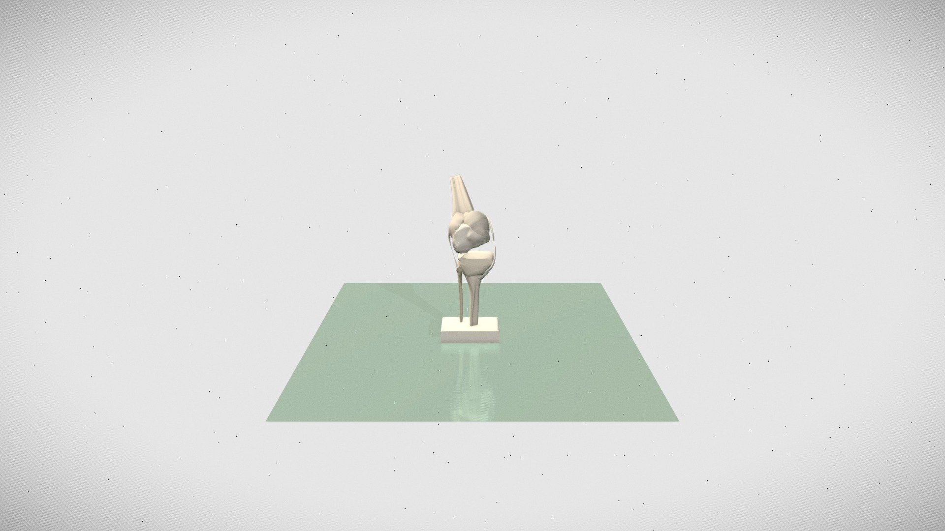 Torn Medial Collateral Ligament - 3D model by cbest [0c6673c] - Sketchfab