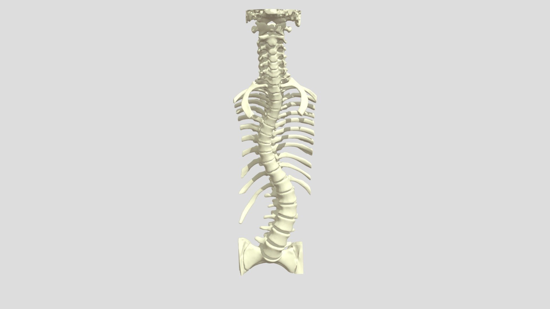 Spine Scoliosis - 3D model by Segmenta Biomodelos (@SegmentaBiomodelos ...