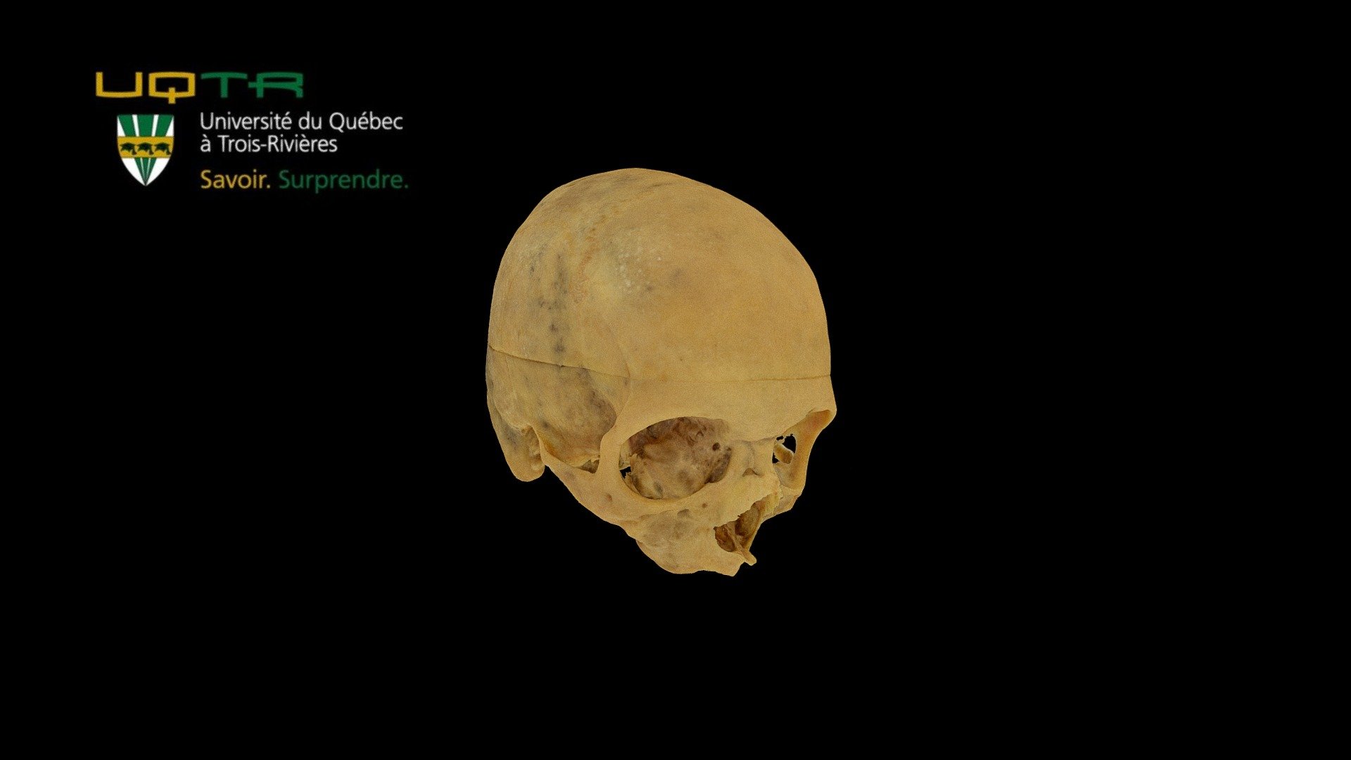 Crâne / Skull - 3D model by Anatomie UQTR - Anatomy UQTR (@AnatomieUQTR ...