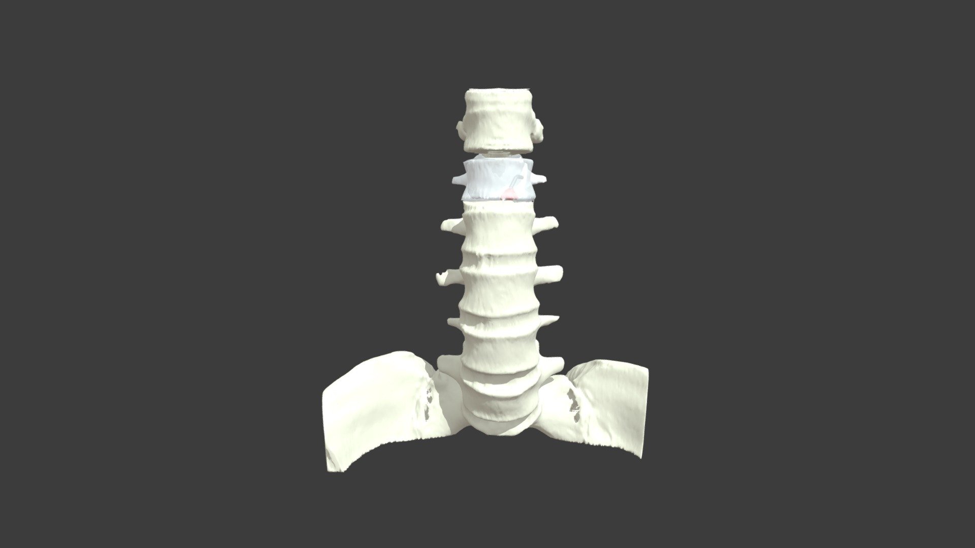modelanatomic_wp2 - 3D model by Hospital Verge de la Cinta Tortosa ...